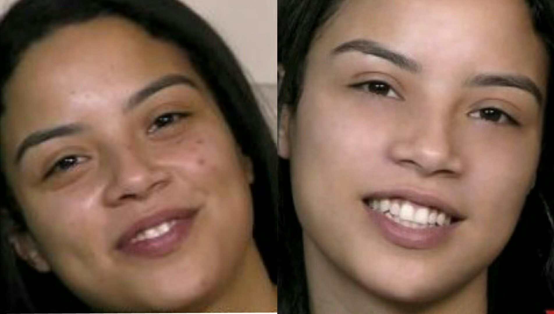 Maya Bijou before and after | Scrolller