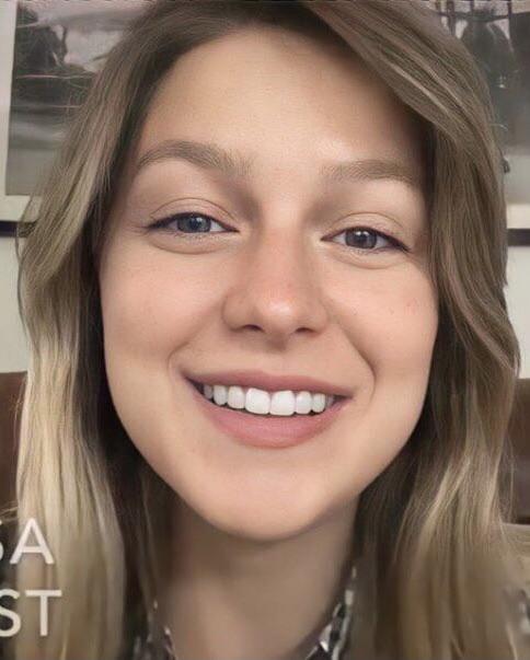 Melissa Benoist has one of those faces you just wanna cum all over. | Scrolller