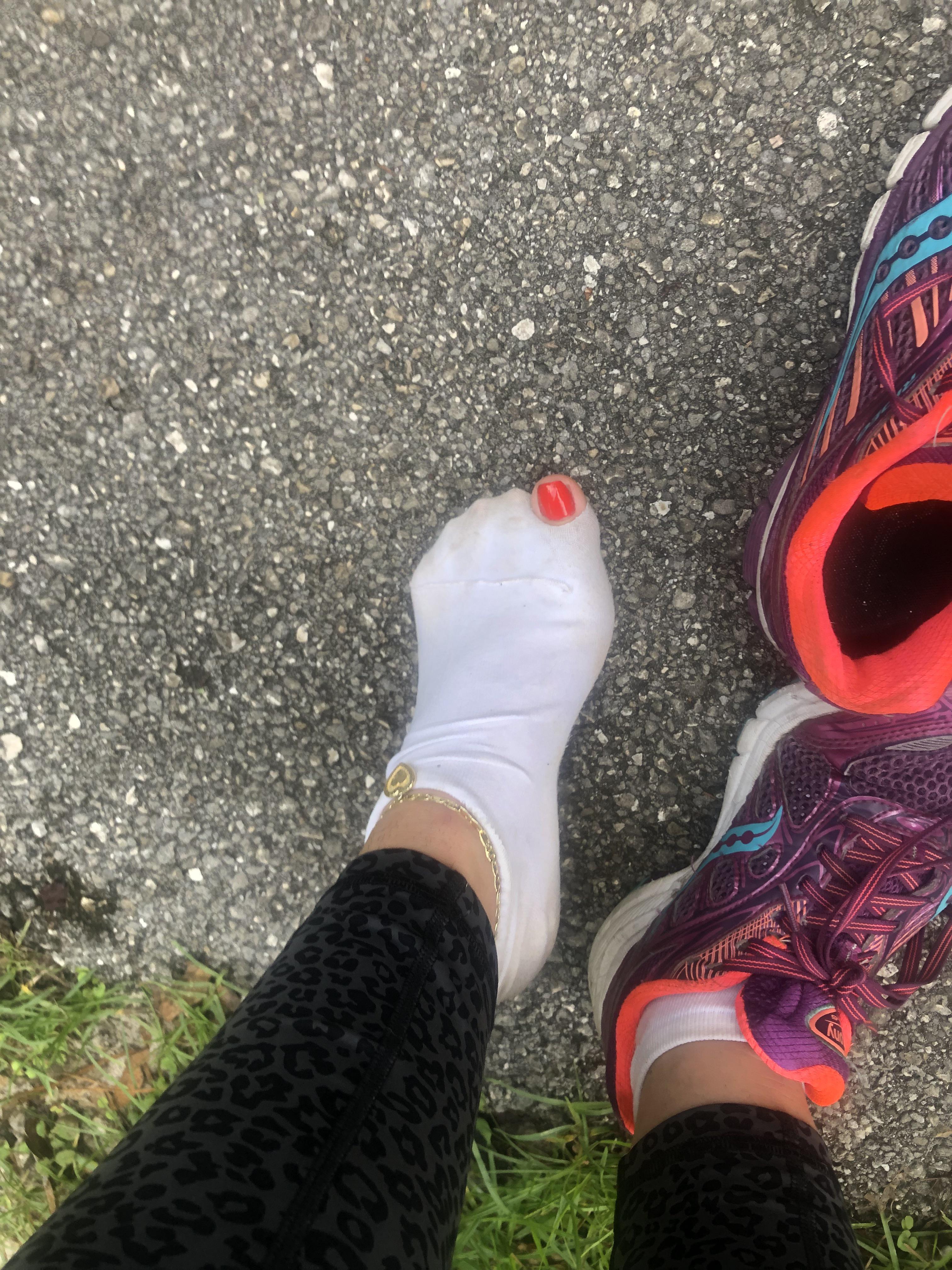 Mid run toe decided to say peek a boo 🙃 | Scrolller