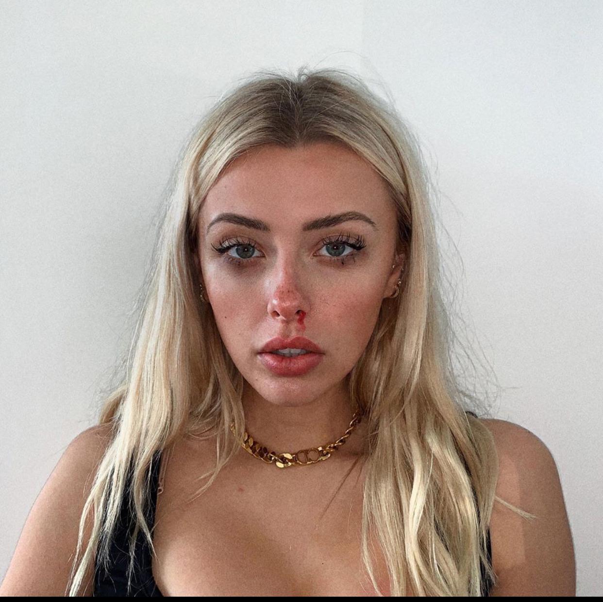 Mugshot new insta | Scrolller