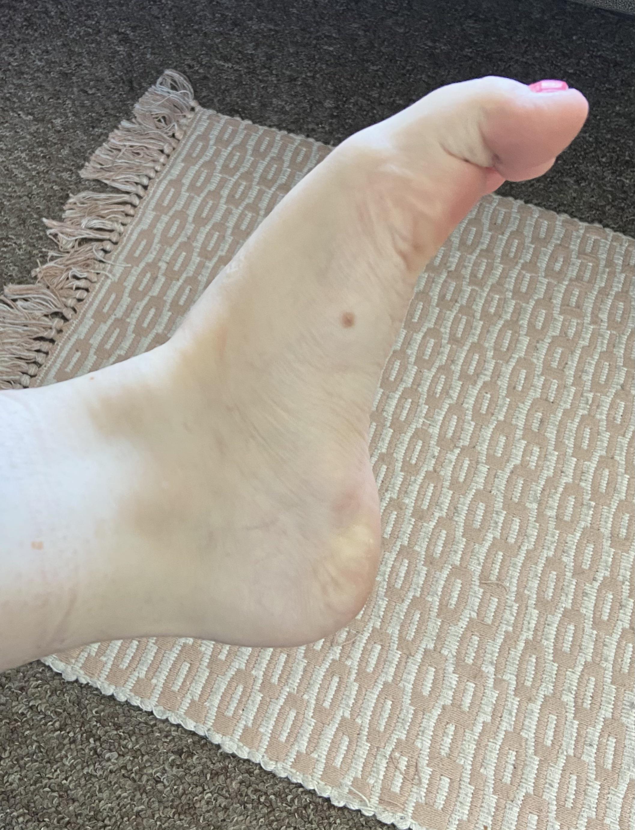 My arches ache :( kiss them better? 💖 | Scrolller