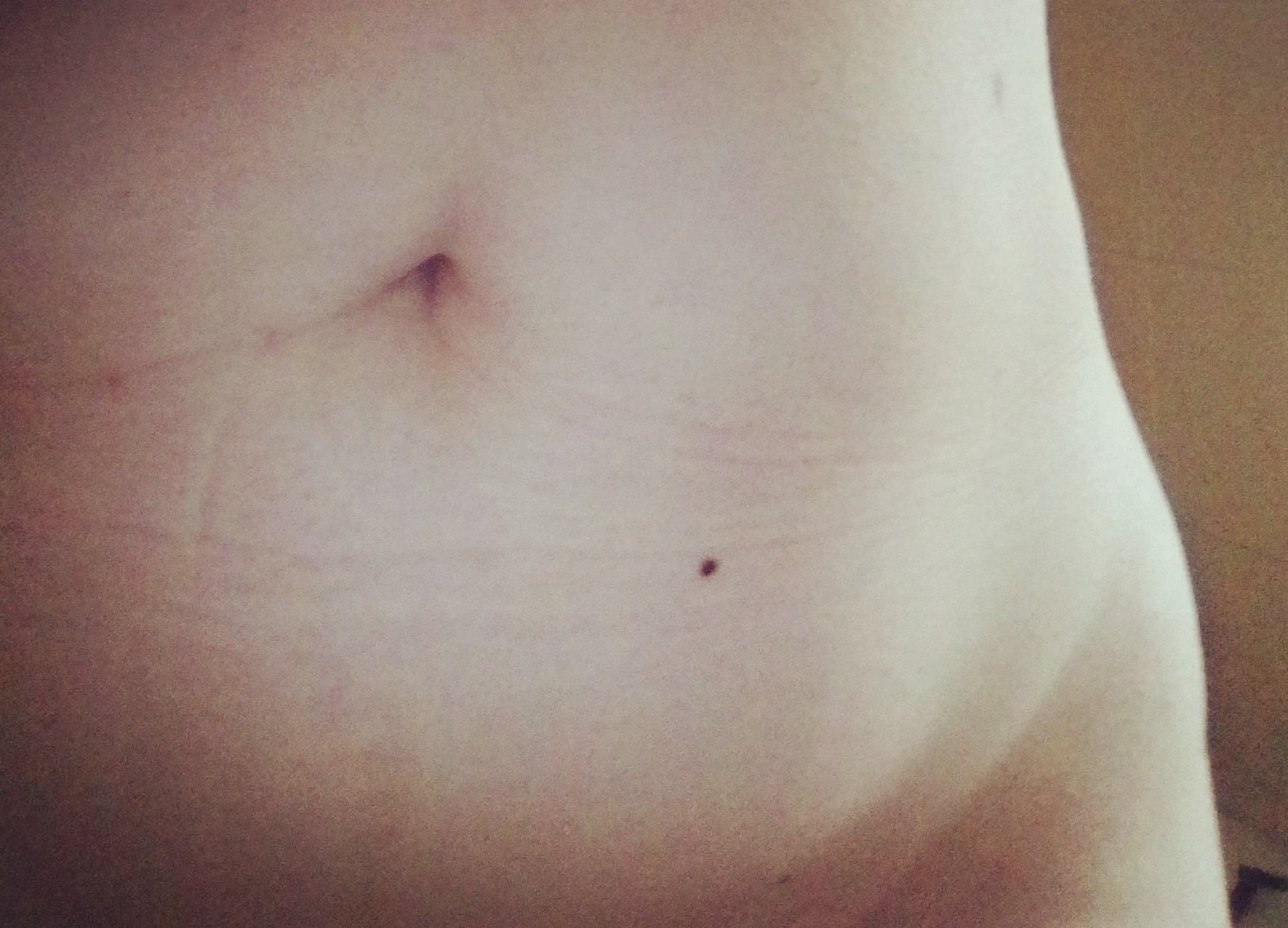 My chubby belly | Scrolller