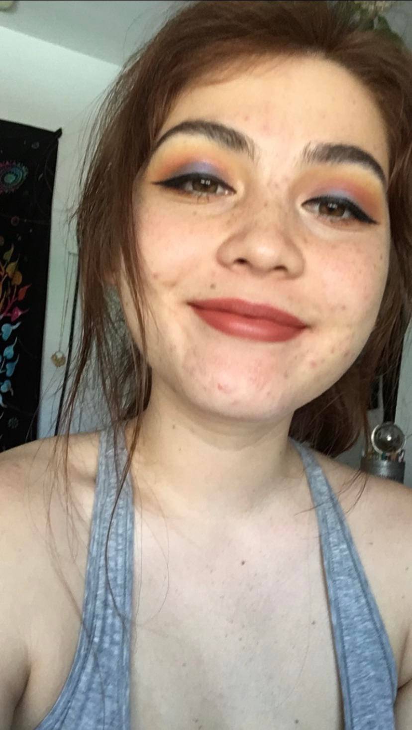 My freckles always fade in the winter :( | Scrolller