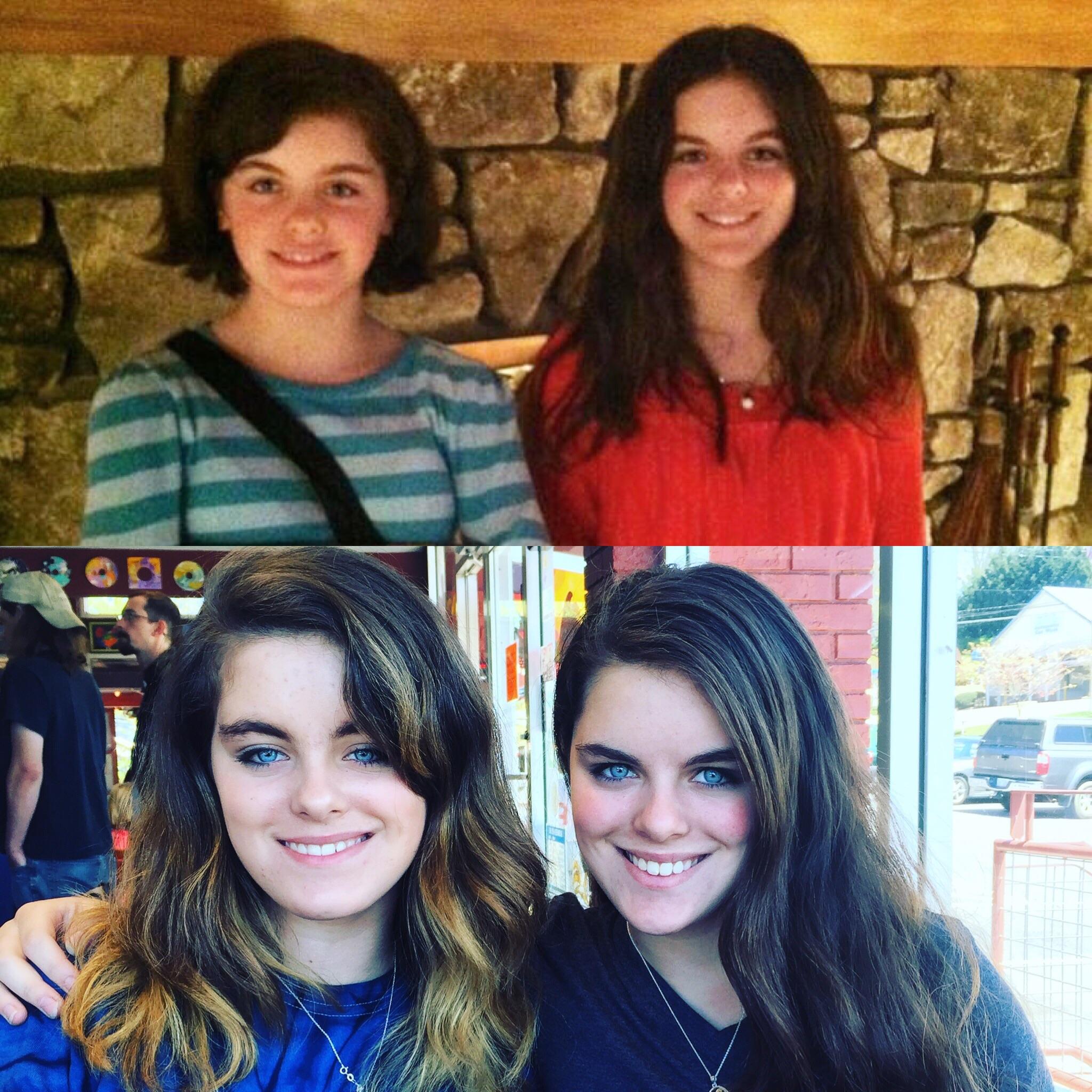 My identical twin (right) and me (left) at age 8 and now at age 16 ...