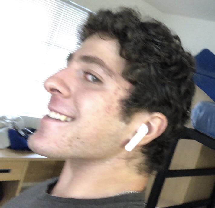 My large nose is kept company by my equally ridiculous chin | Scrolller