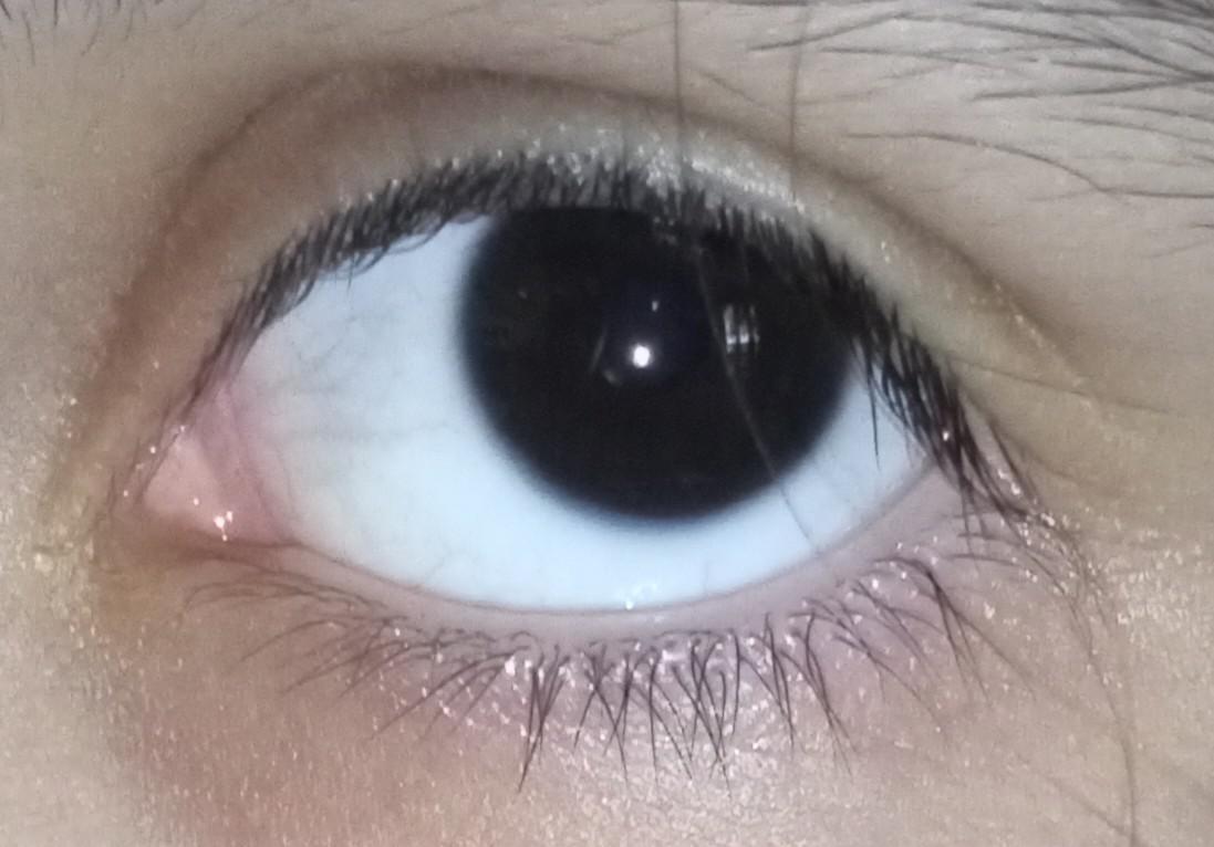 My left eye | Scrolller