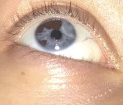 My left eye containing heterochromia | Scrolller