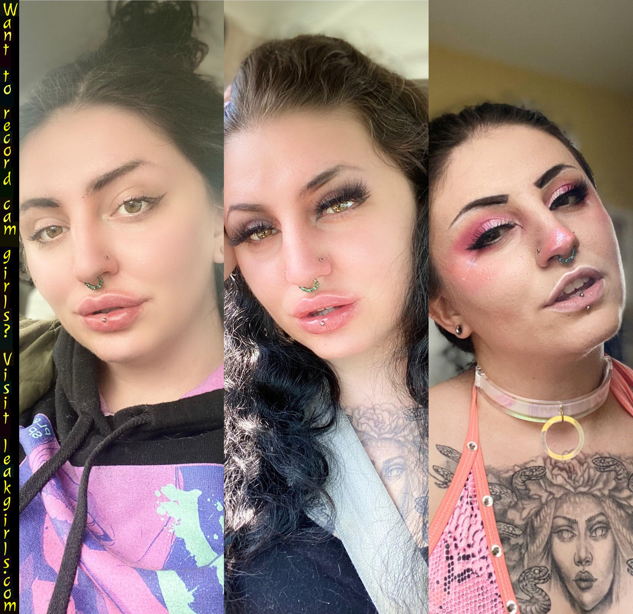 My lips in July vs September vs December! | Scrolller