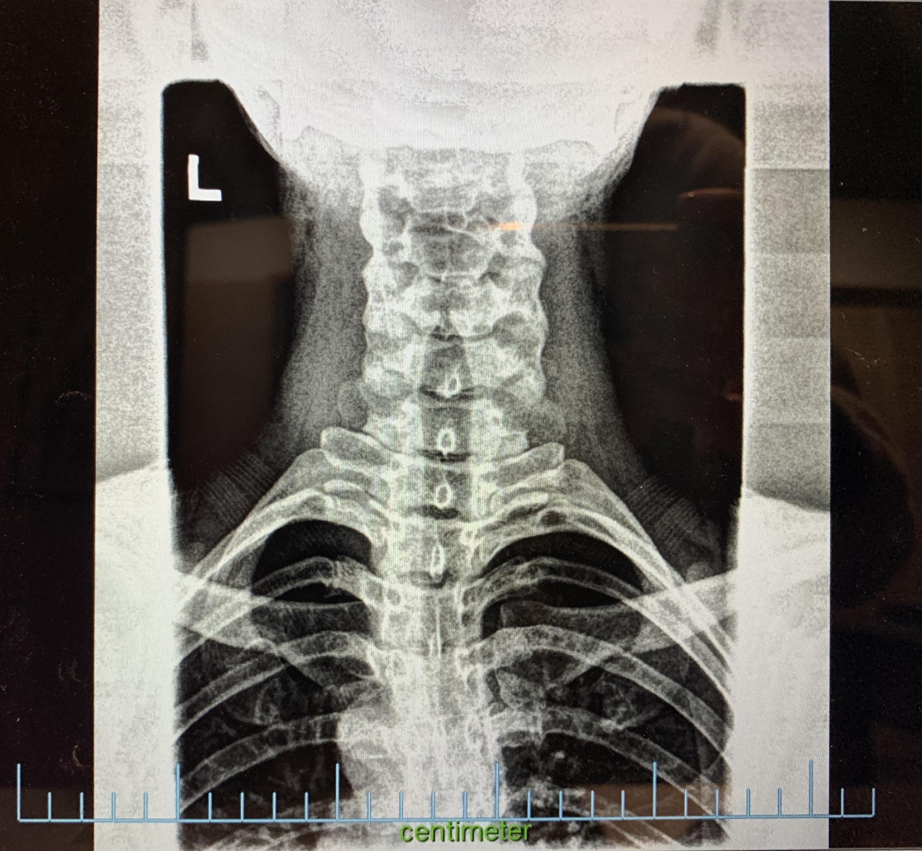 My neck X-ray | Scrolller