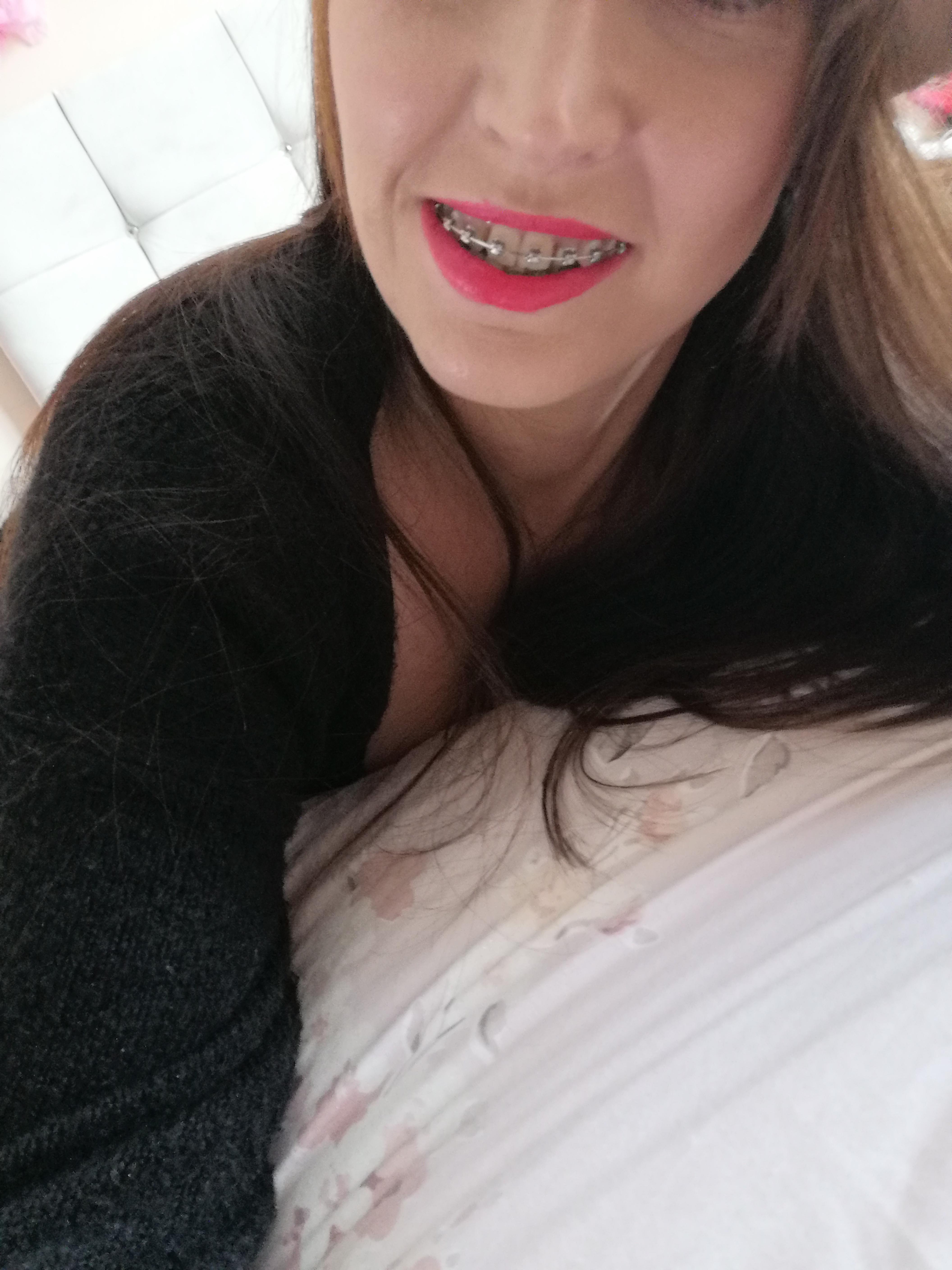 My teeth jewellery 😁😁 | Scrolller