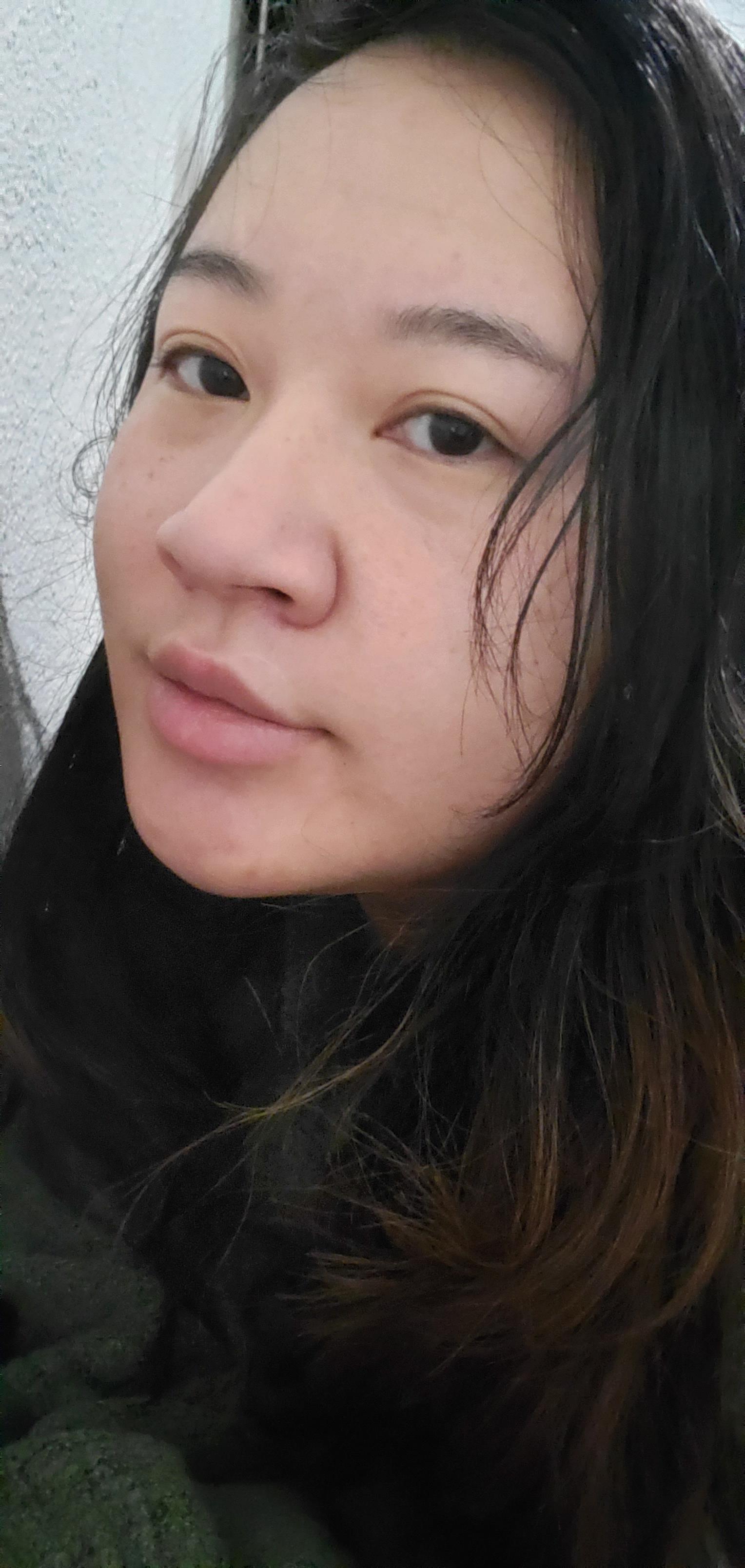 No makeup, actual face with freckles and scars | Scrolller