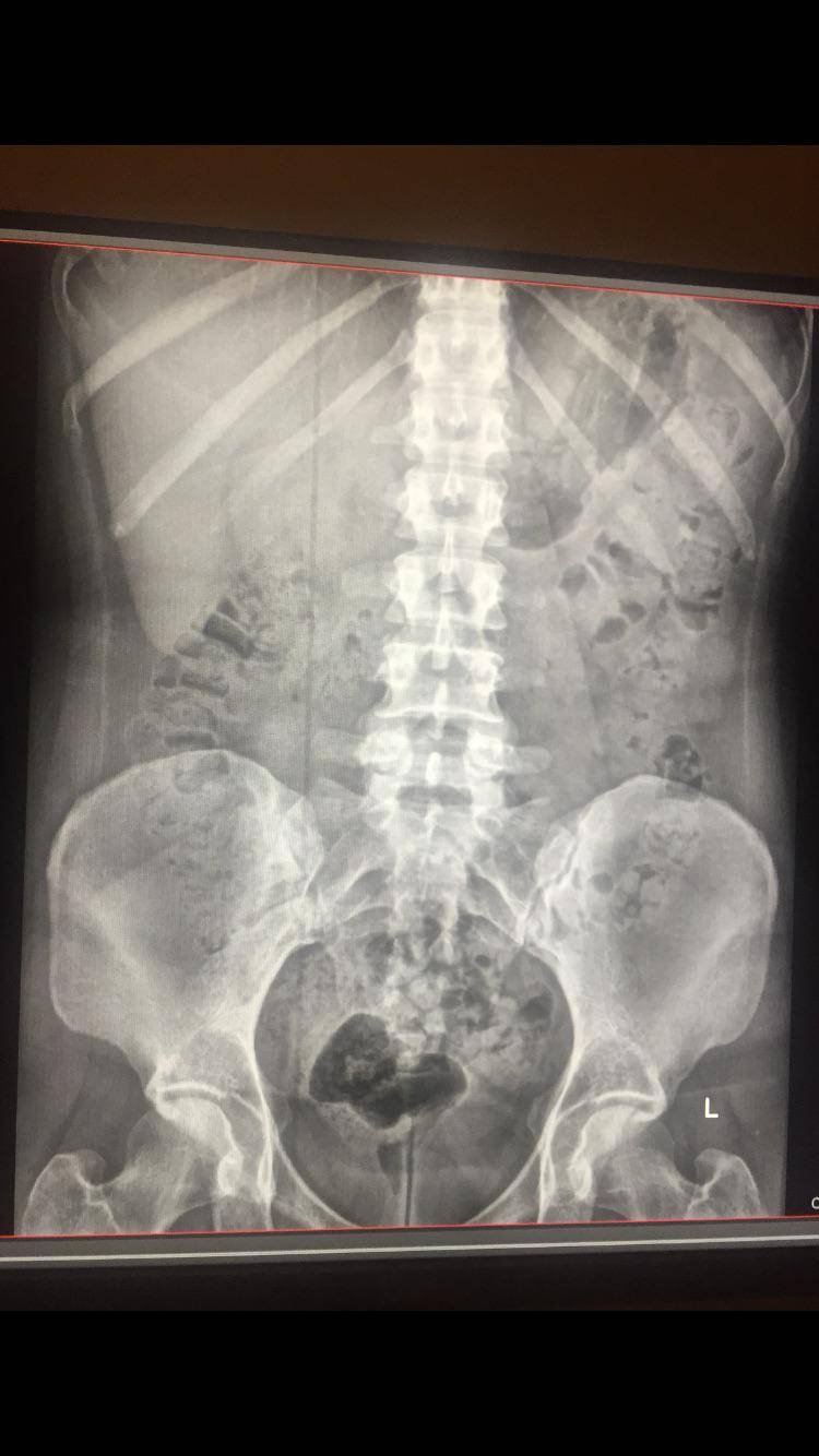 Notice anything cool/weird/interesting? | Scrolller