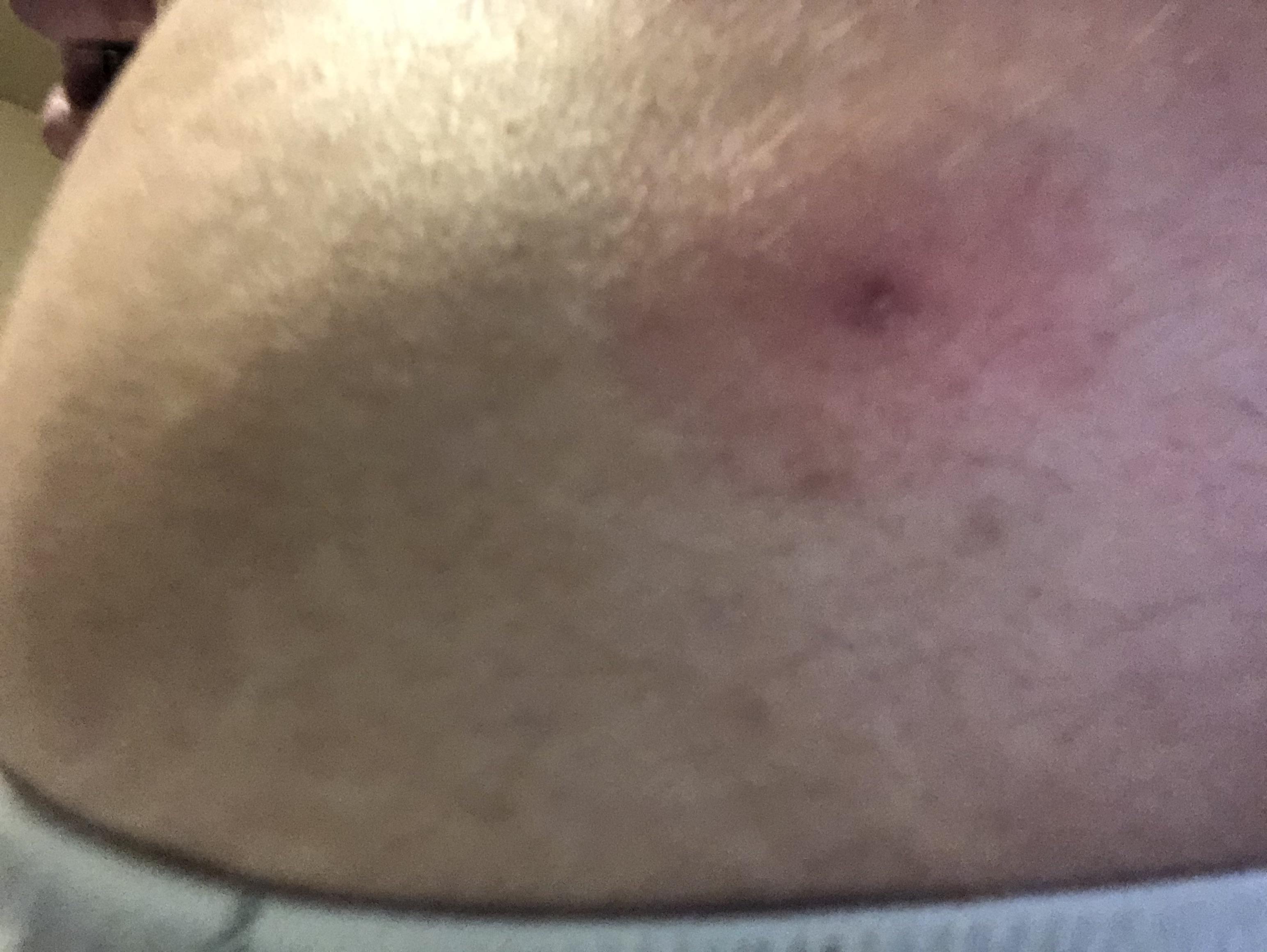 nsfw(?) because of buttcheek(?) but thing thing hurts so bad. | Scrolller