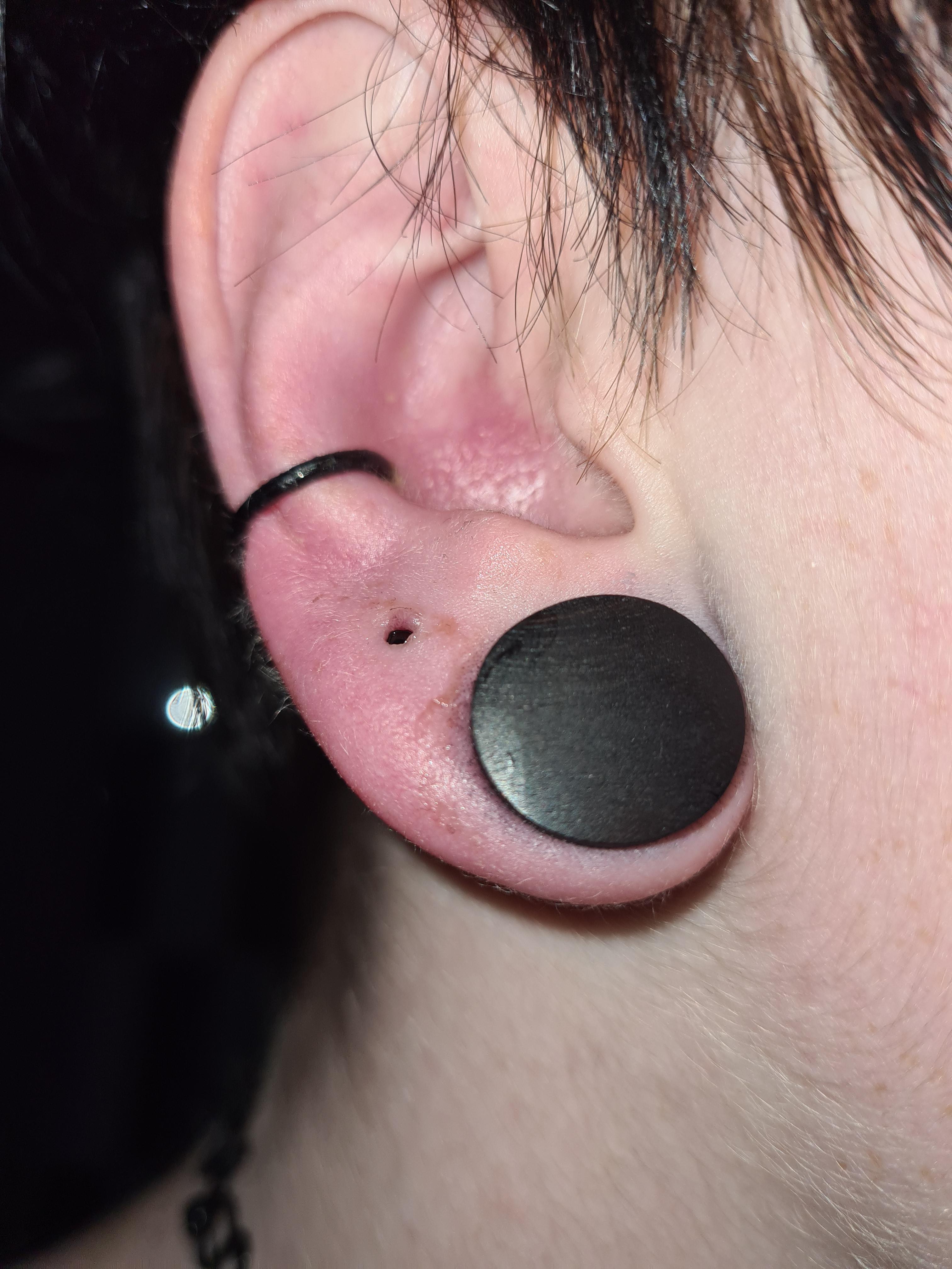 NSFW? Guys can you help me figure this out? This morning I woke up and my 2nd lobe piercing had ...