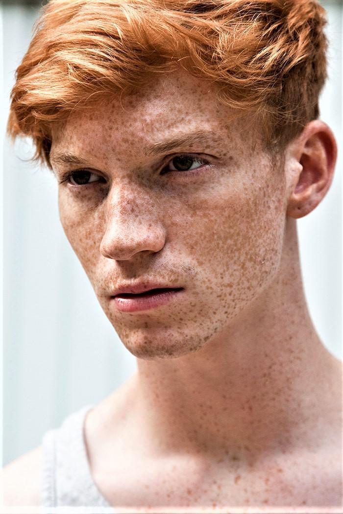 Oh my! This guys freckles. | Scrolller