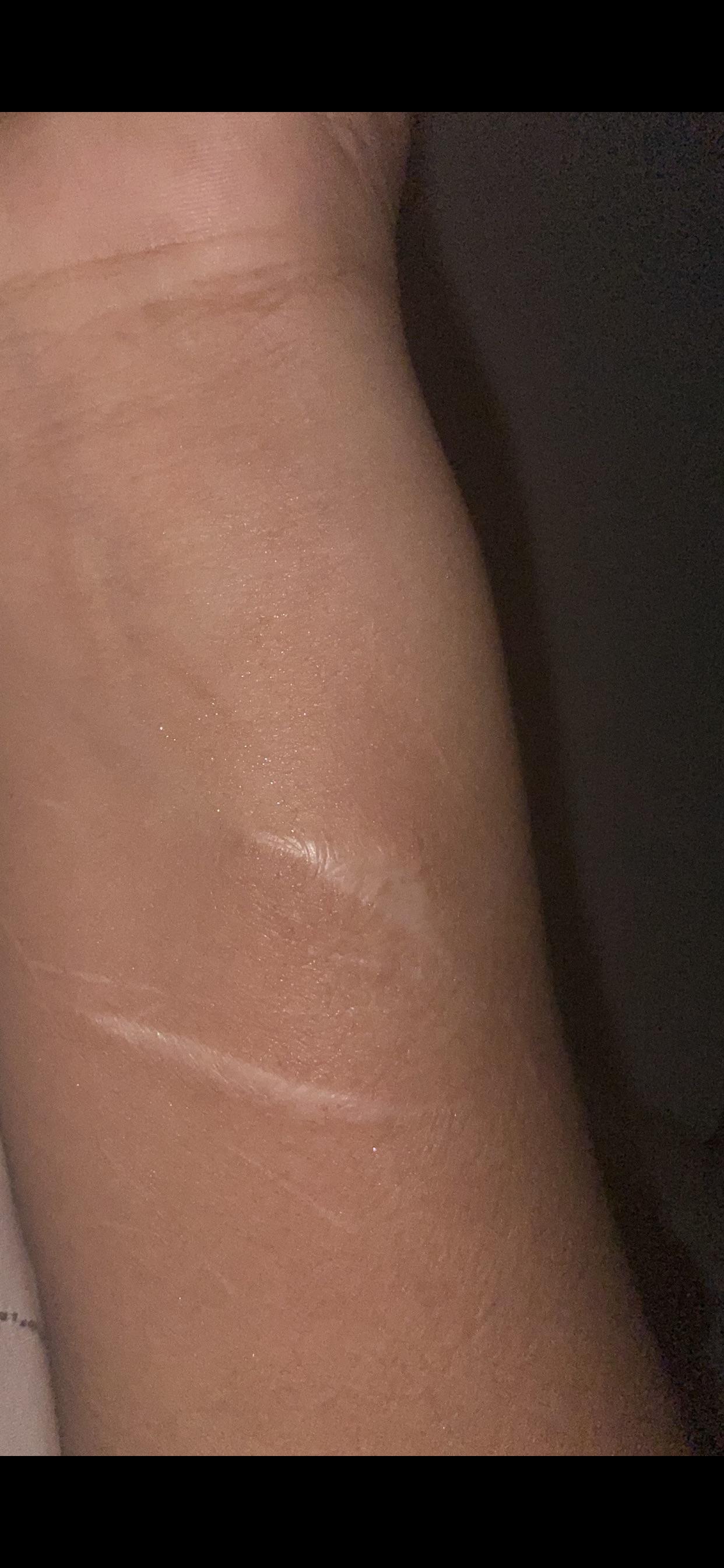 Old scars | Scrolller