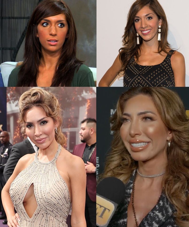 One injection from going too far | Scrolller