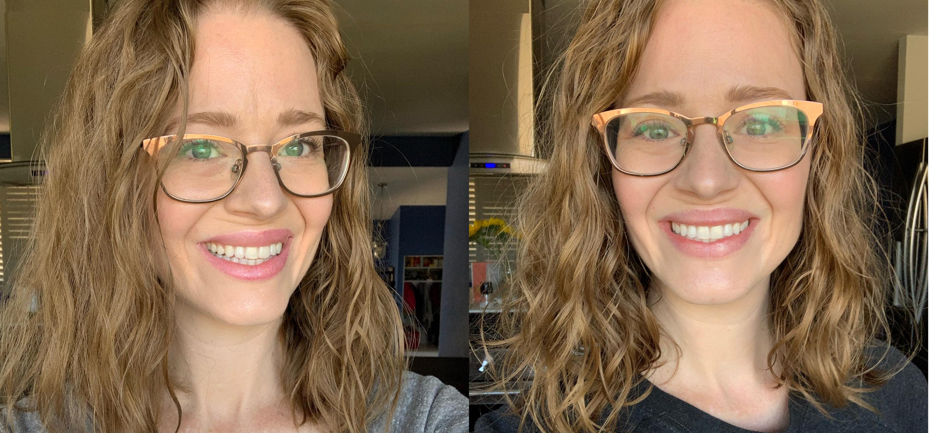 One week difference! Seeing progress | Scrolller