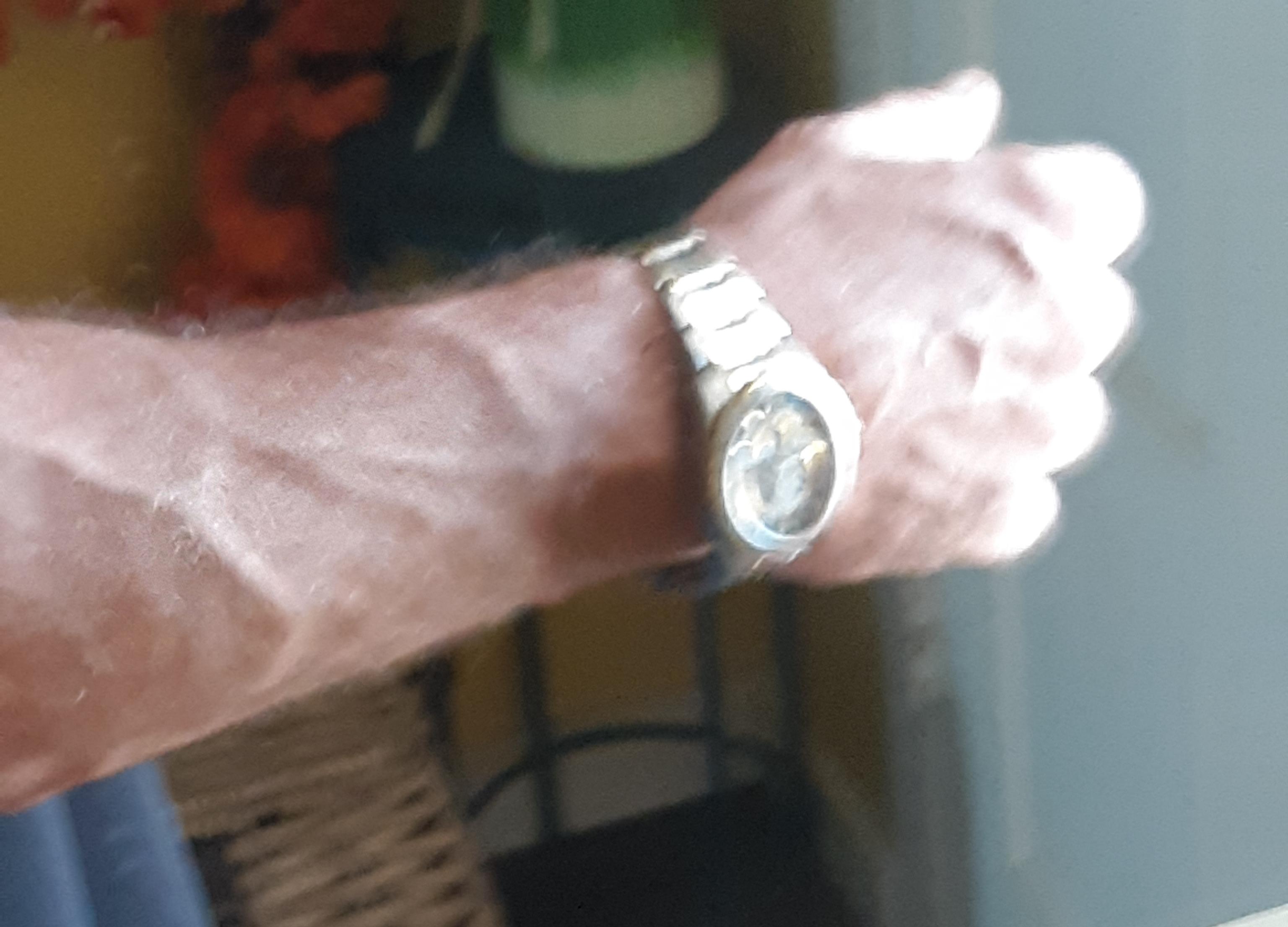 Outside forearm | Scrolller