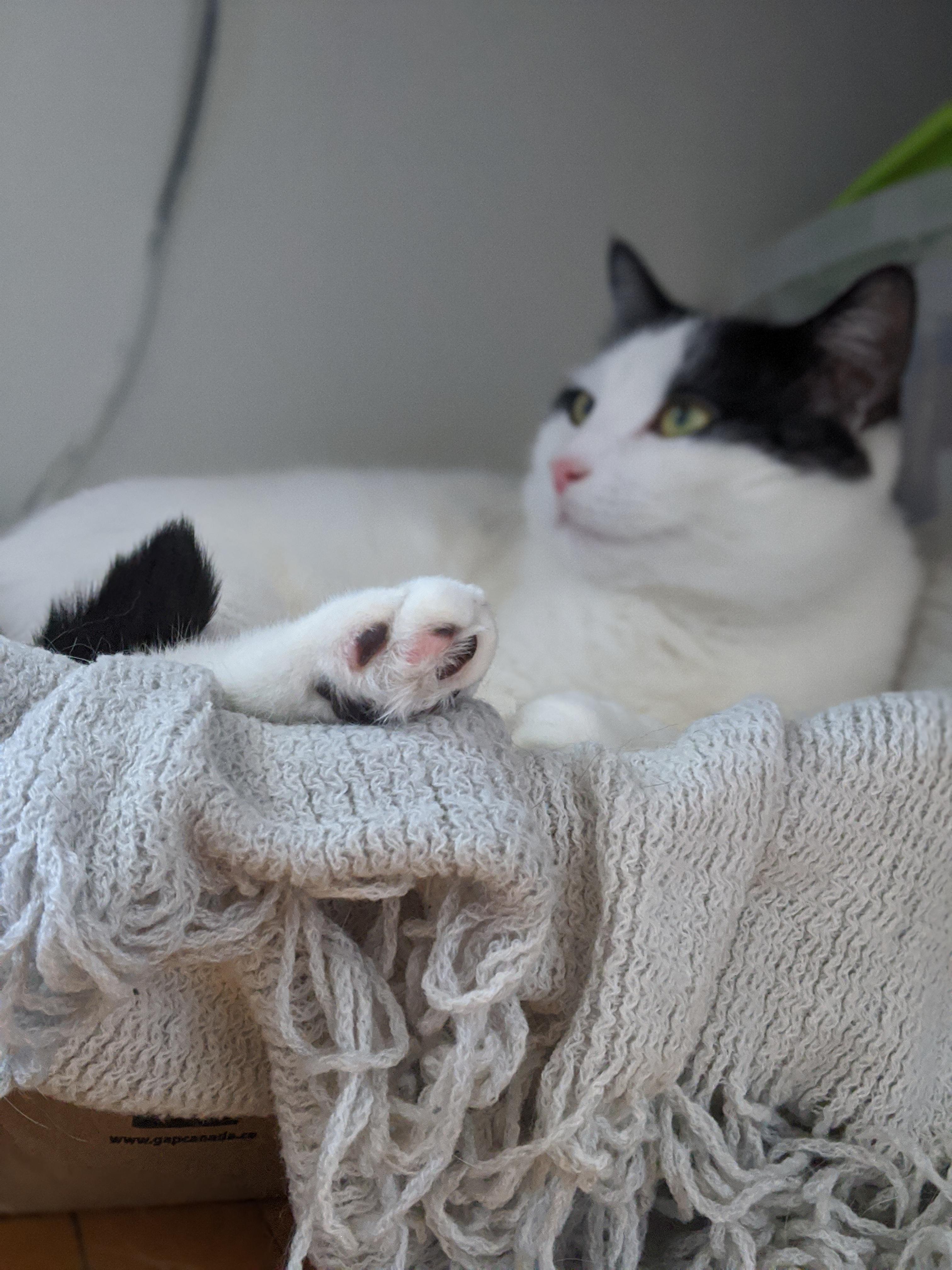Pierre's toe beans | Scrolller