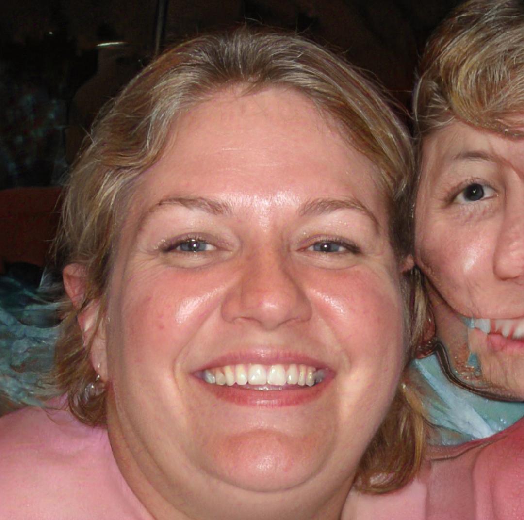 Plastic Surgery gone wrong | Scrolller