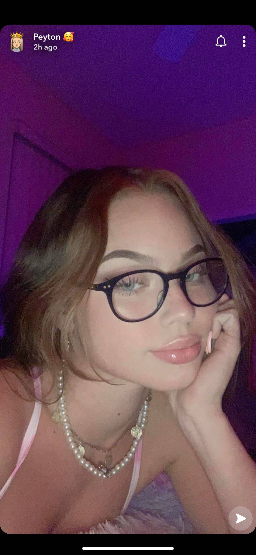 plump lips | Scrolller