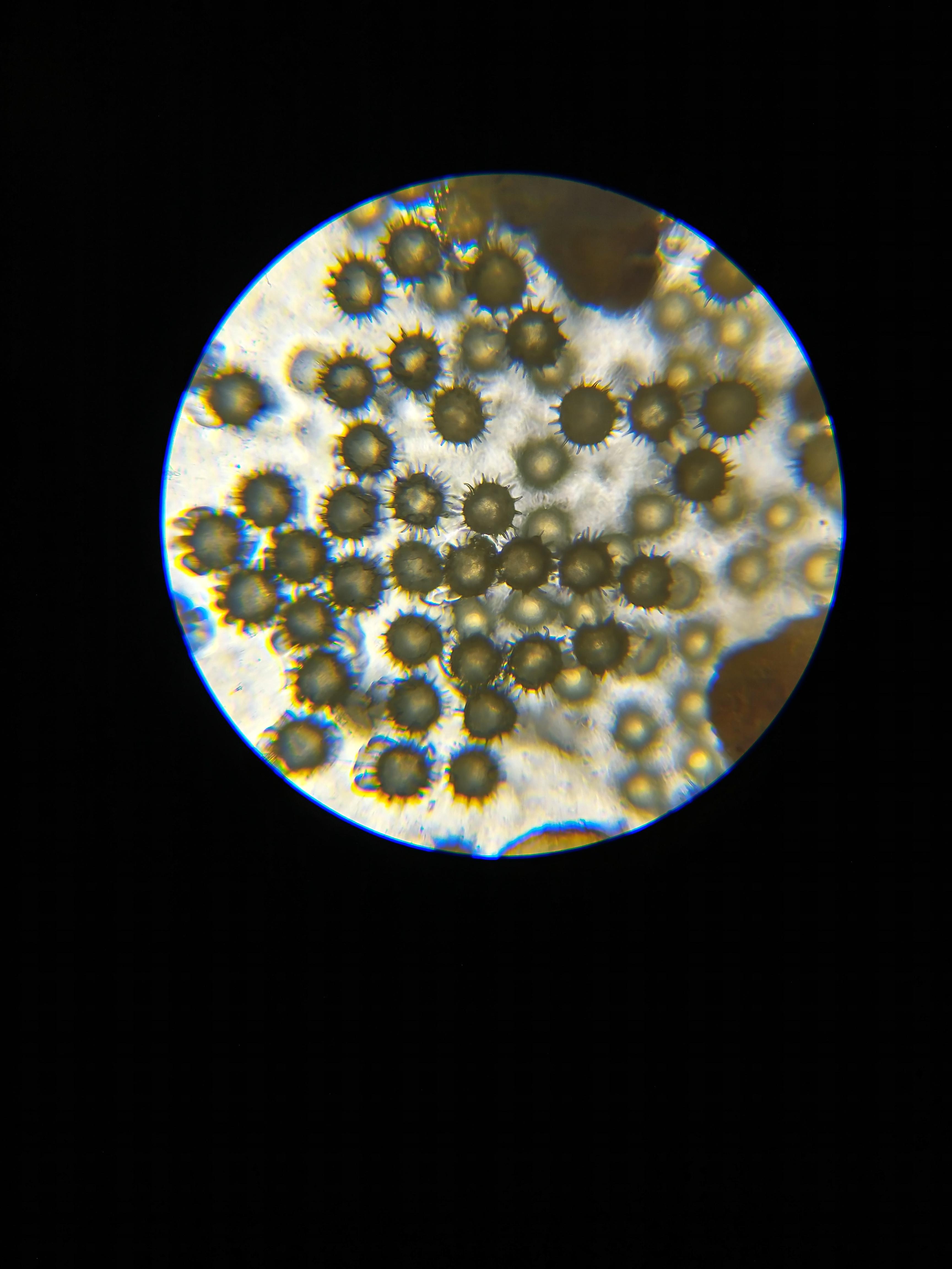 Pollen through a microscope. Easy to see why it makes you sneeze. Spikey balls stabbing your ...