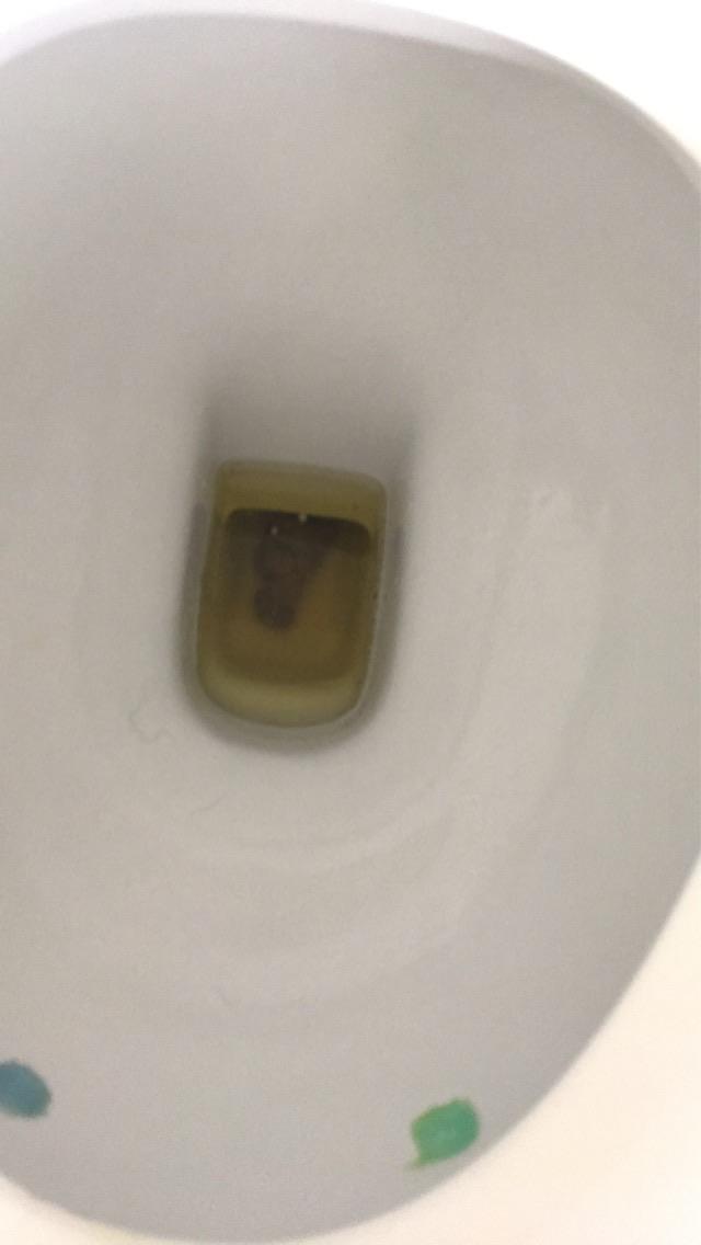 Poo flavoured pee | Scrolller