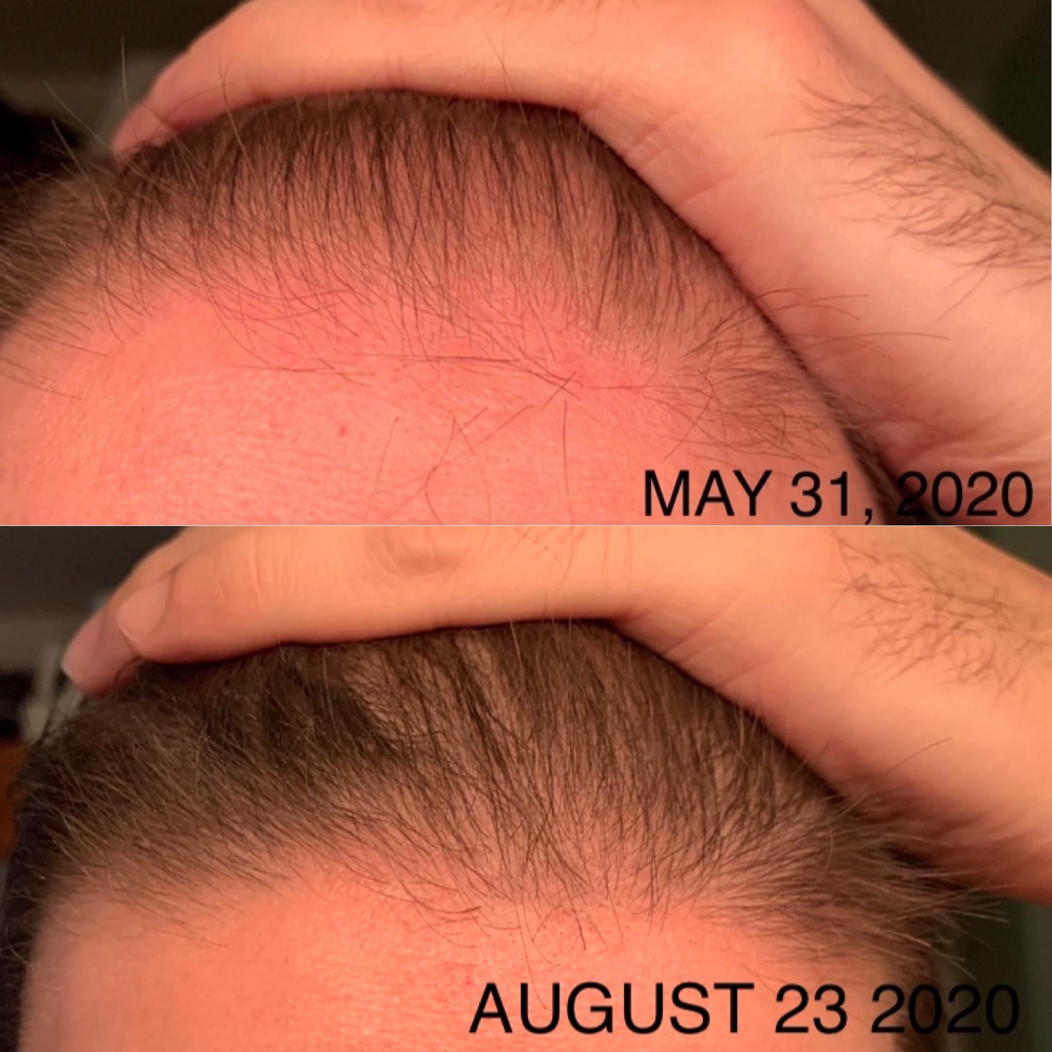 Progress? | Scrolller