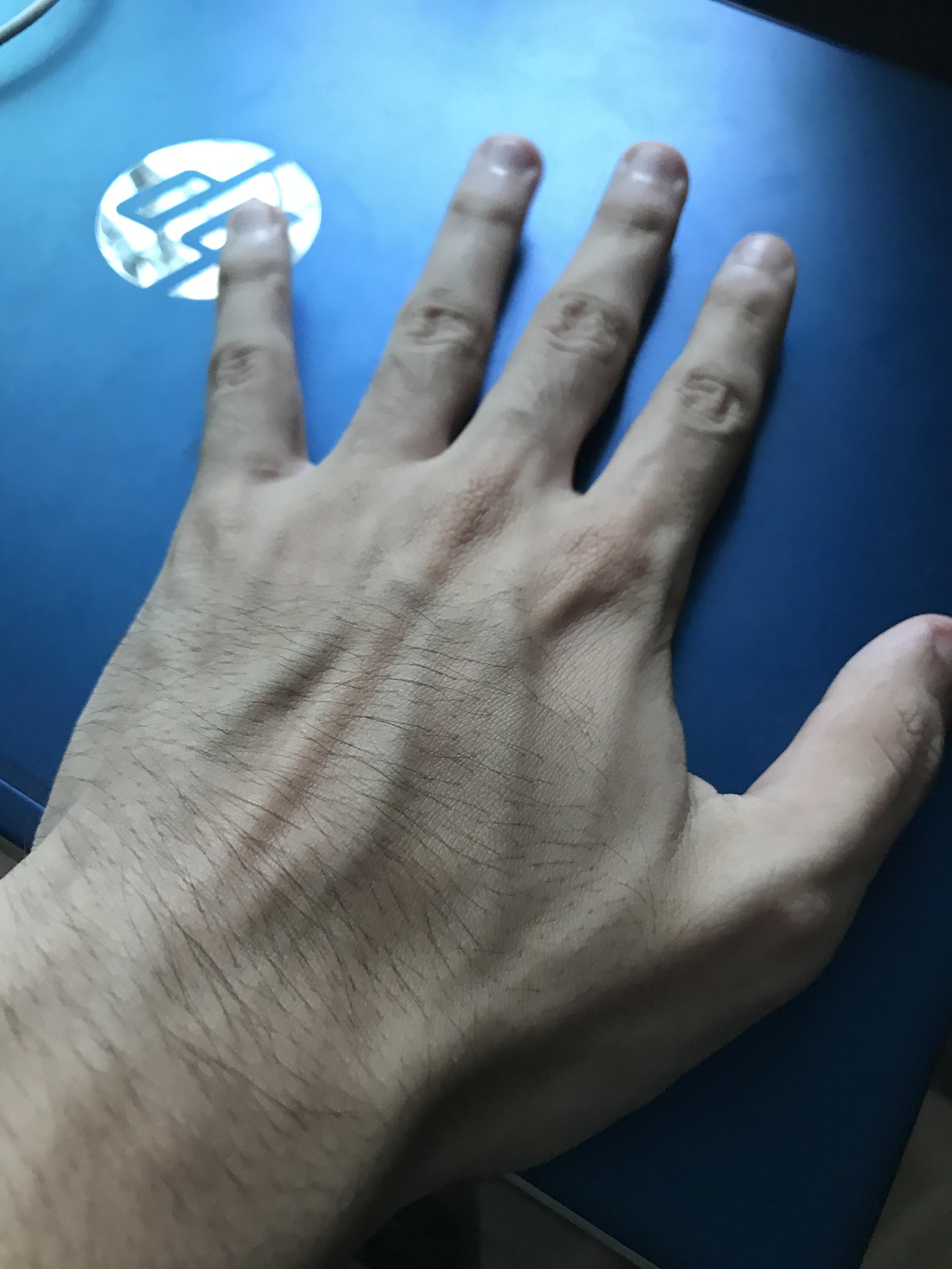 Putting pressure lifts my veins uwu | Scrolller