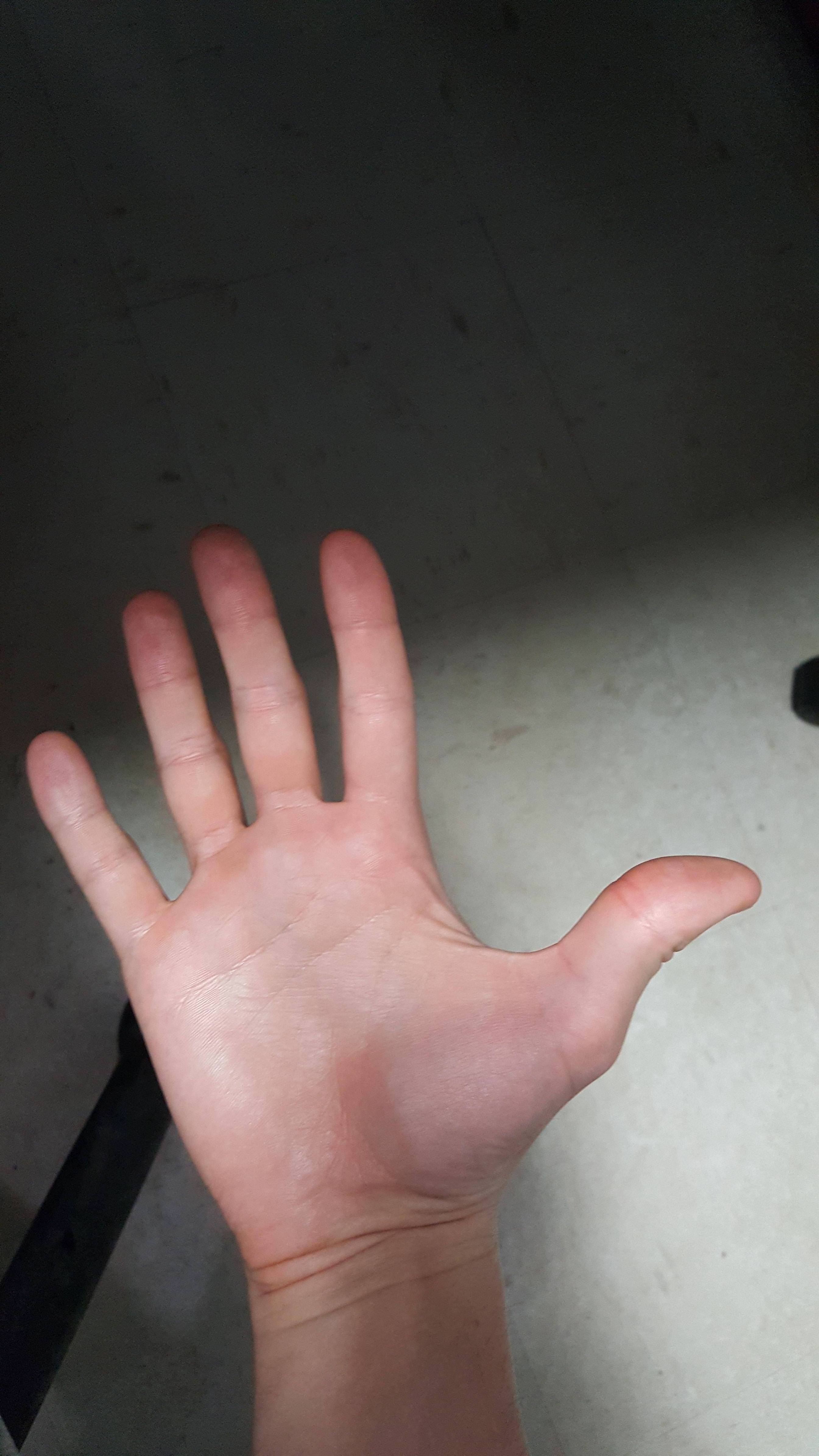 Rate my hand | Scrolller