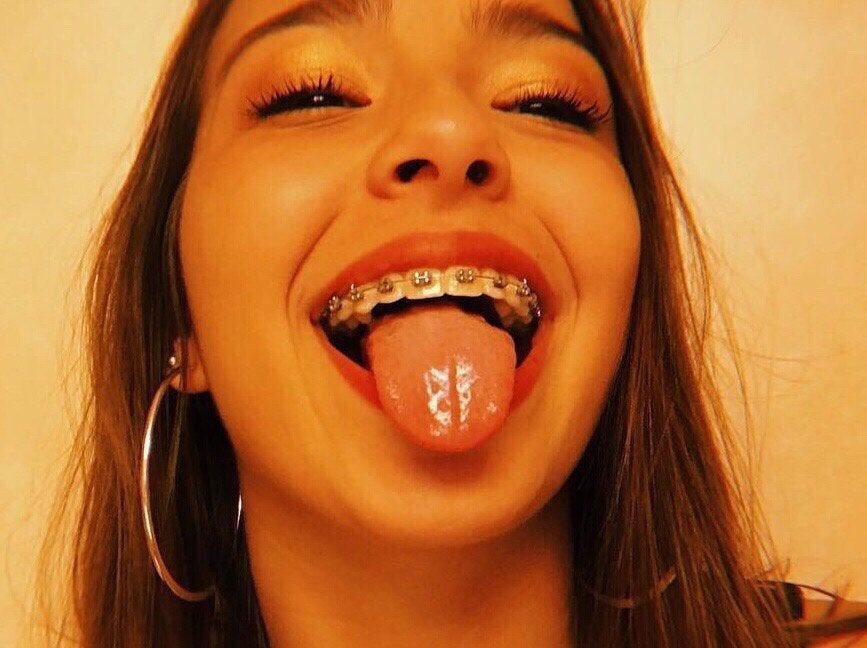 Ready for your cum all over her braces | Scrolller