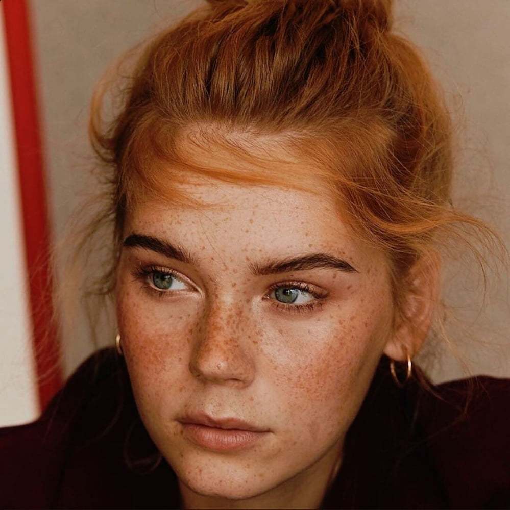 Red with freckles | Scrolller