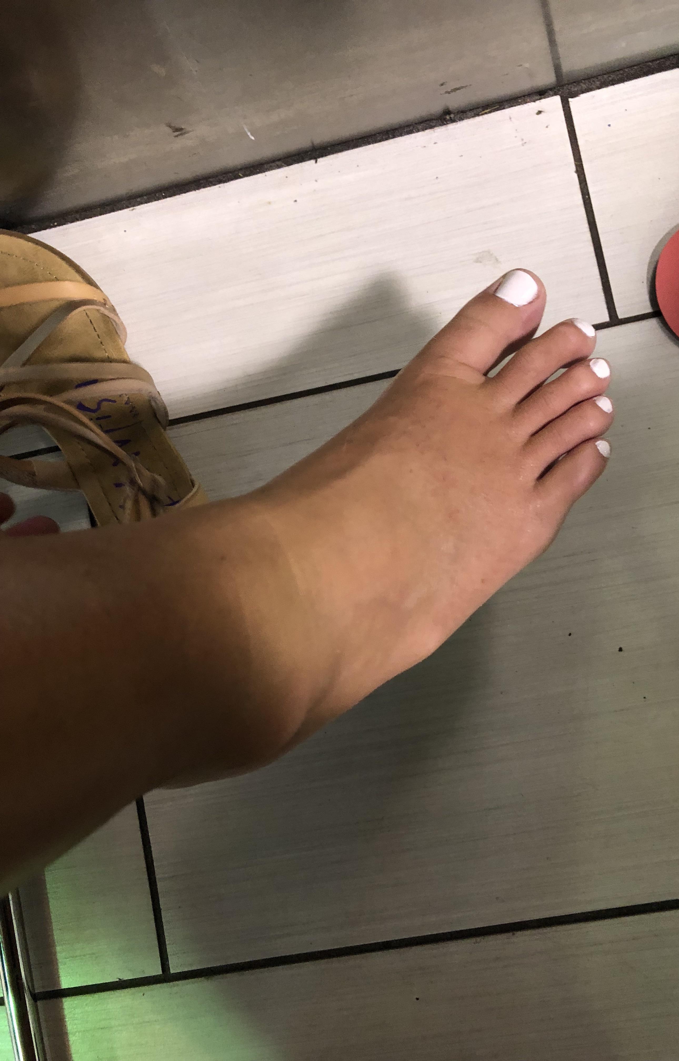 Rolled her bad ankle on uneven sidewalk and takes her sandal off in public for everyone to see 😏 ...