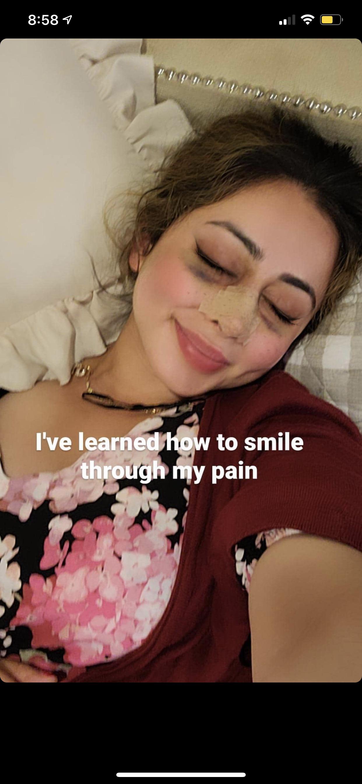 She look like she got knocked tf out. Is that a broken nose??? | Scrolller