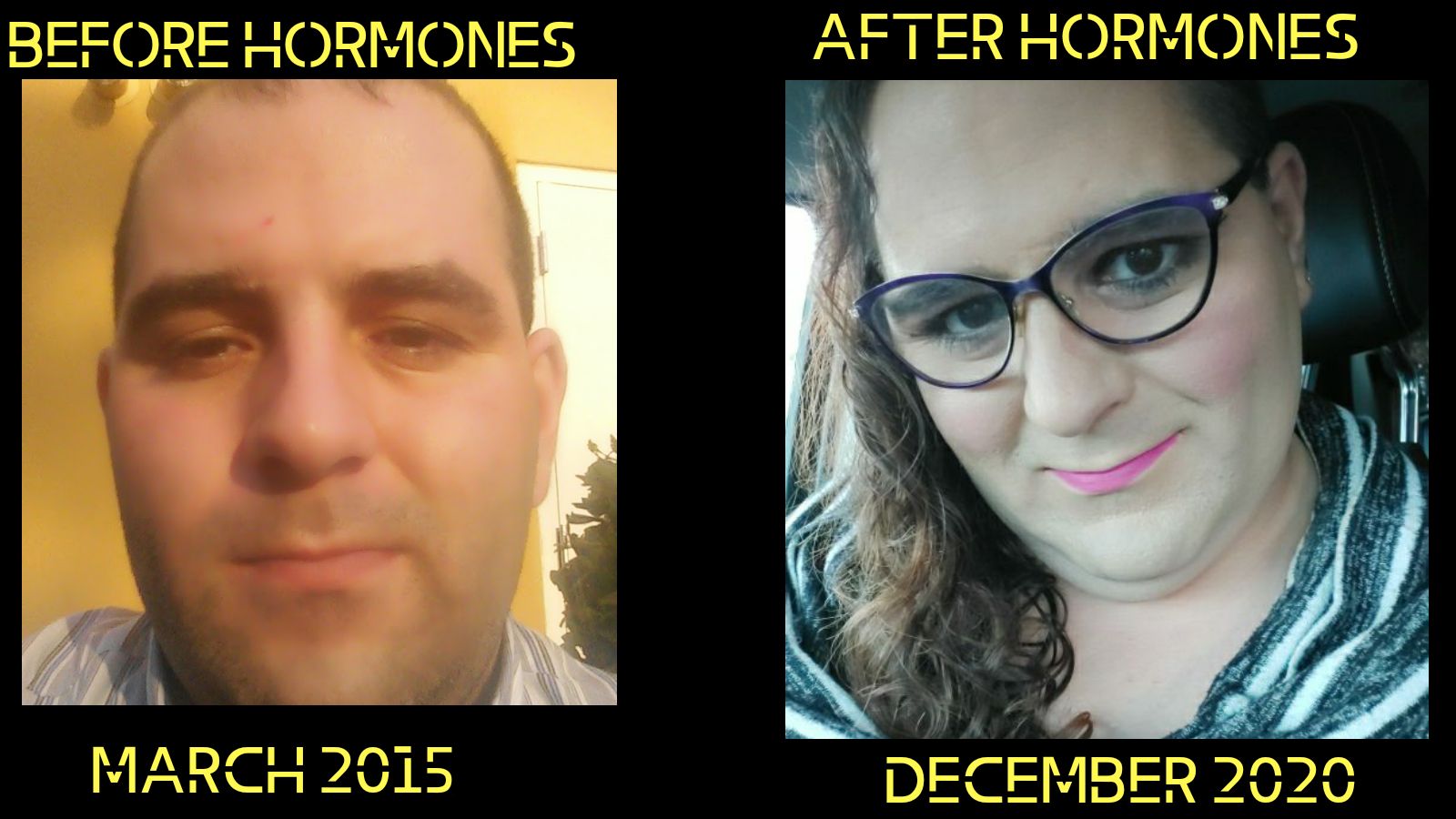 Sissy before and after hormones | Scrolller