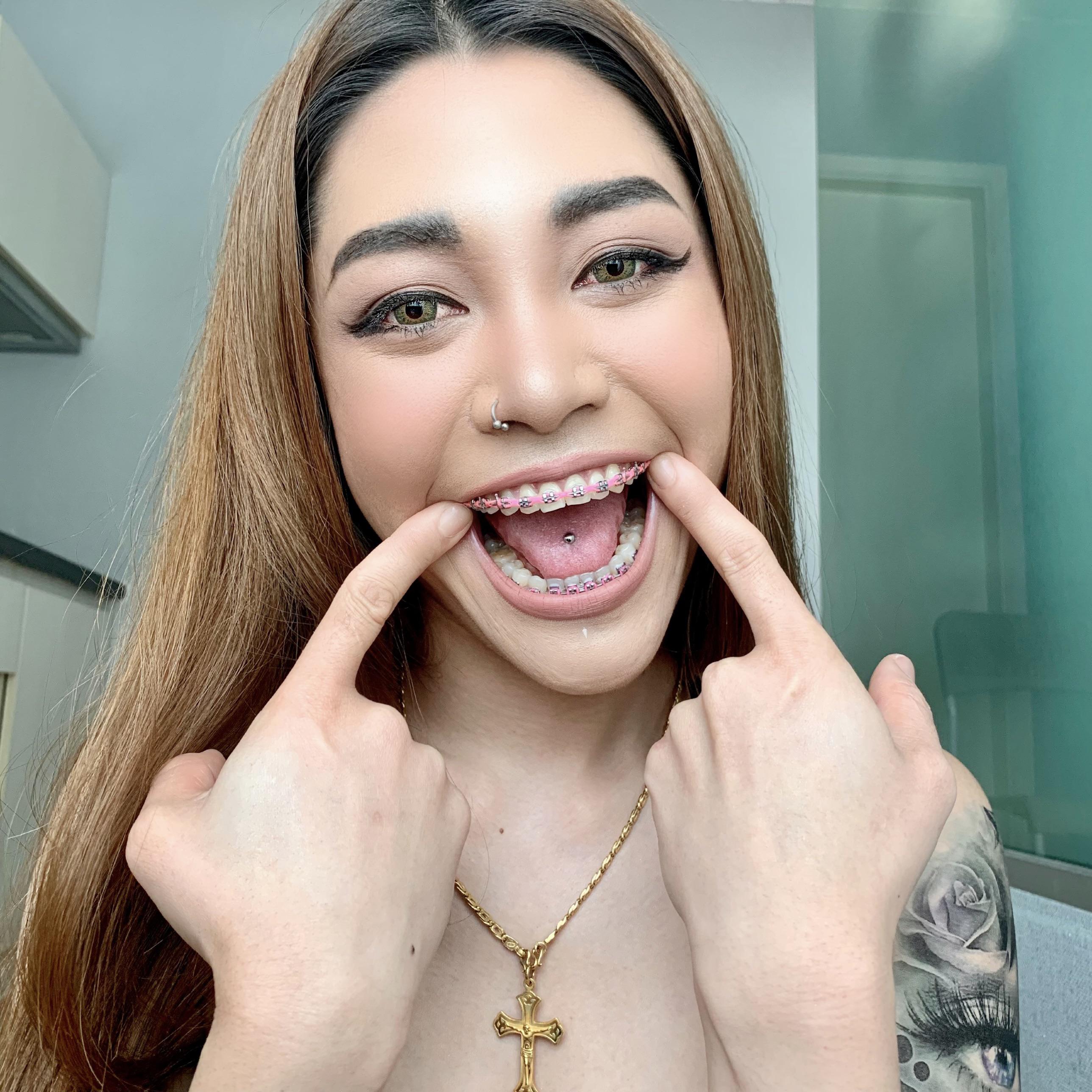 Somethings missing in my mouth 😏 | Scrolller