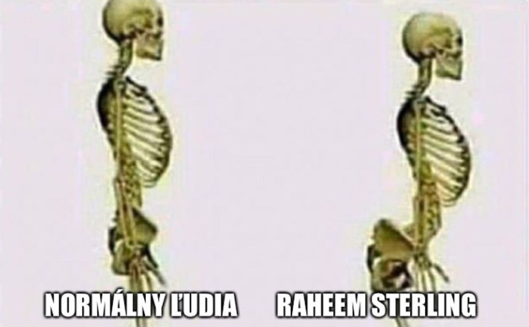 Sterling😅😅😅😅😅 | Scrolller