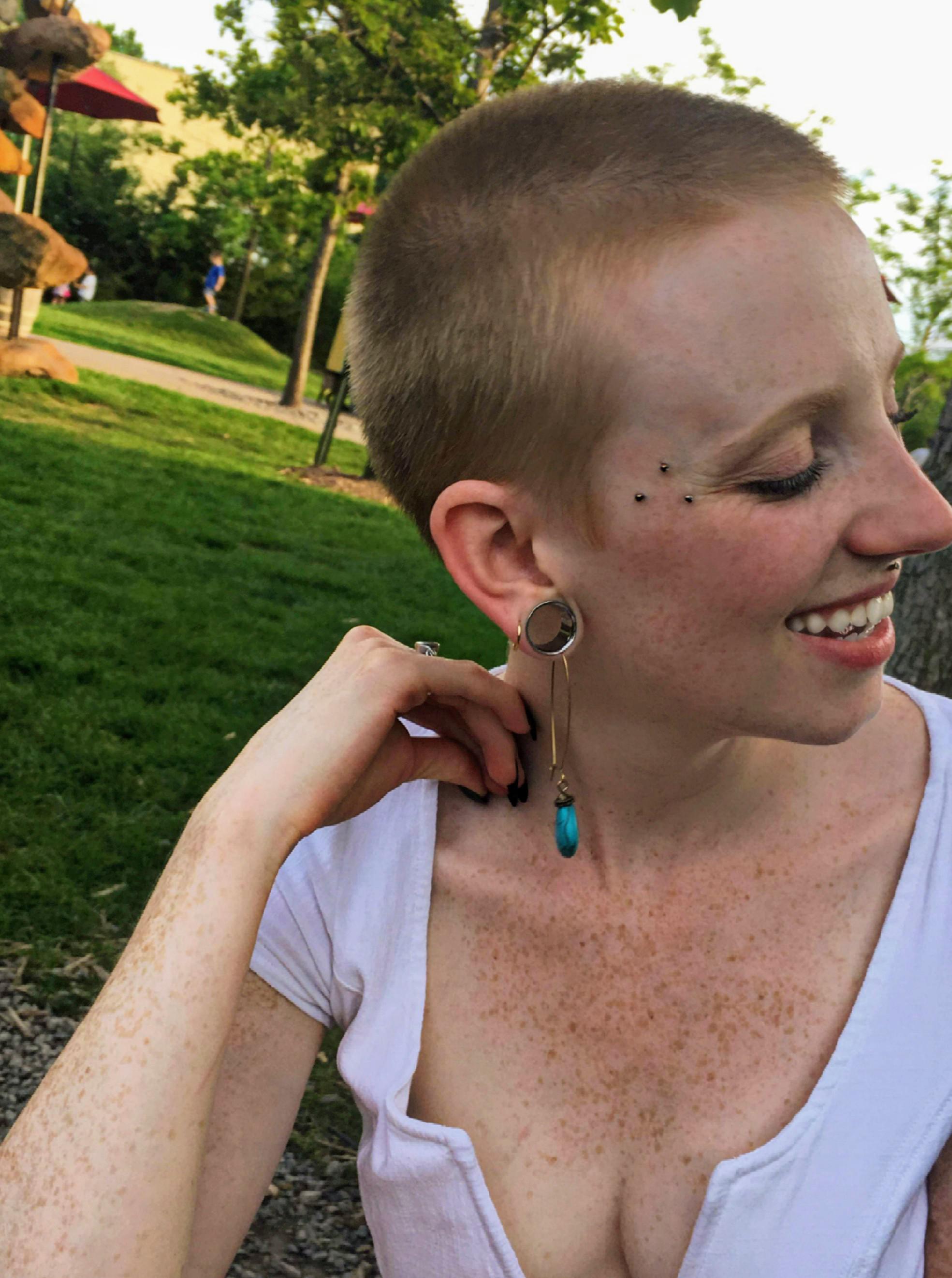 Summer freckles | Scrolller