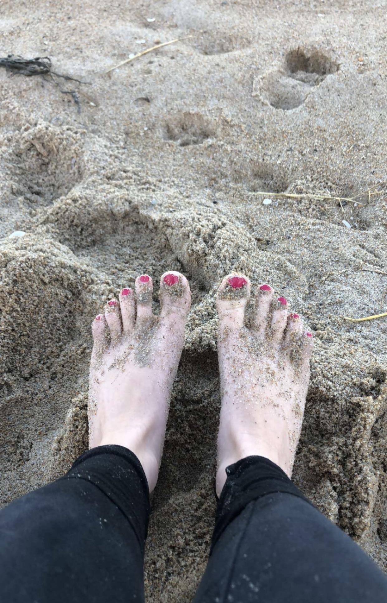 Super sandy toes! | Scrolller