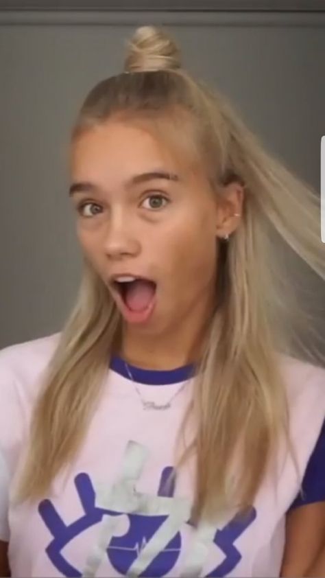 Surprised | Scrolller