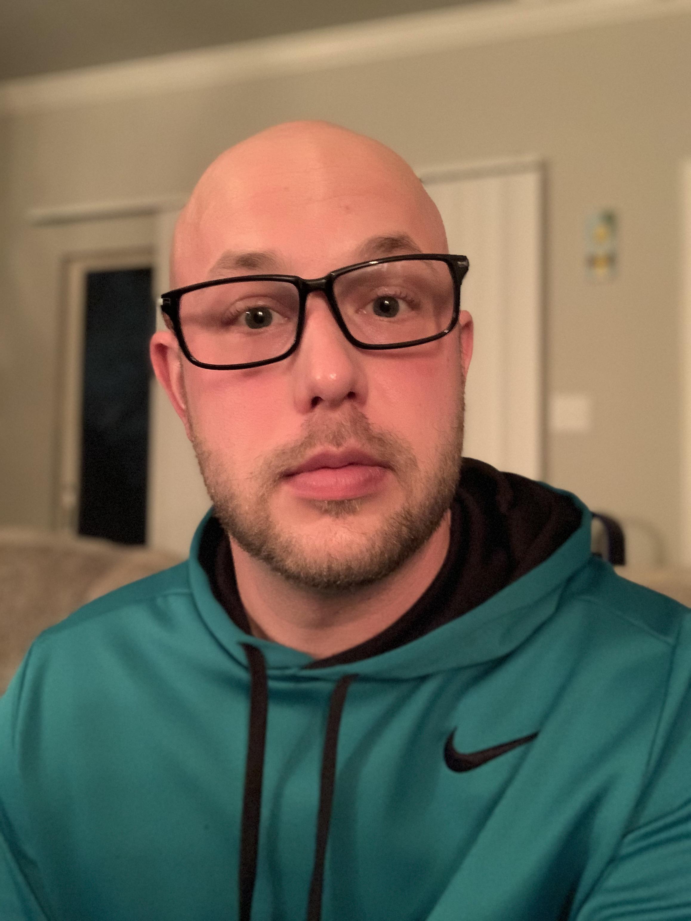 That new glasses feeling | Scrolller