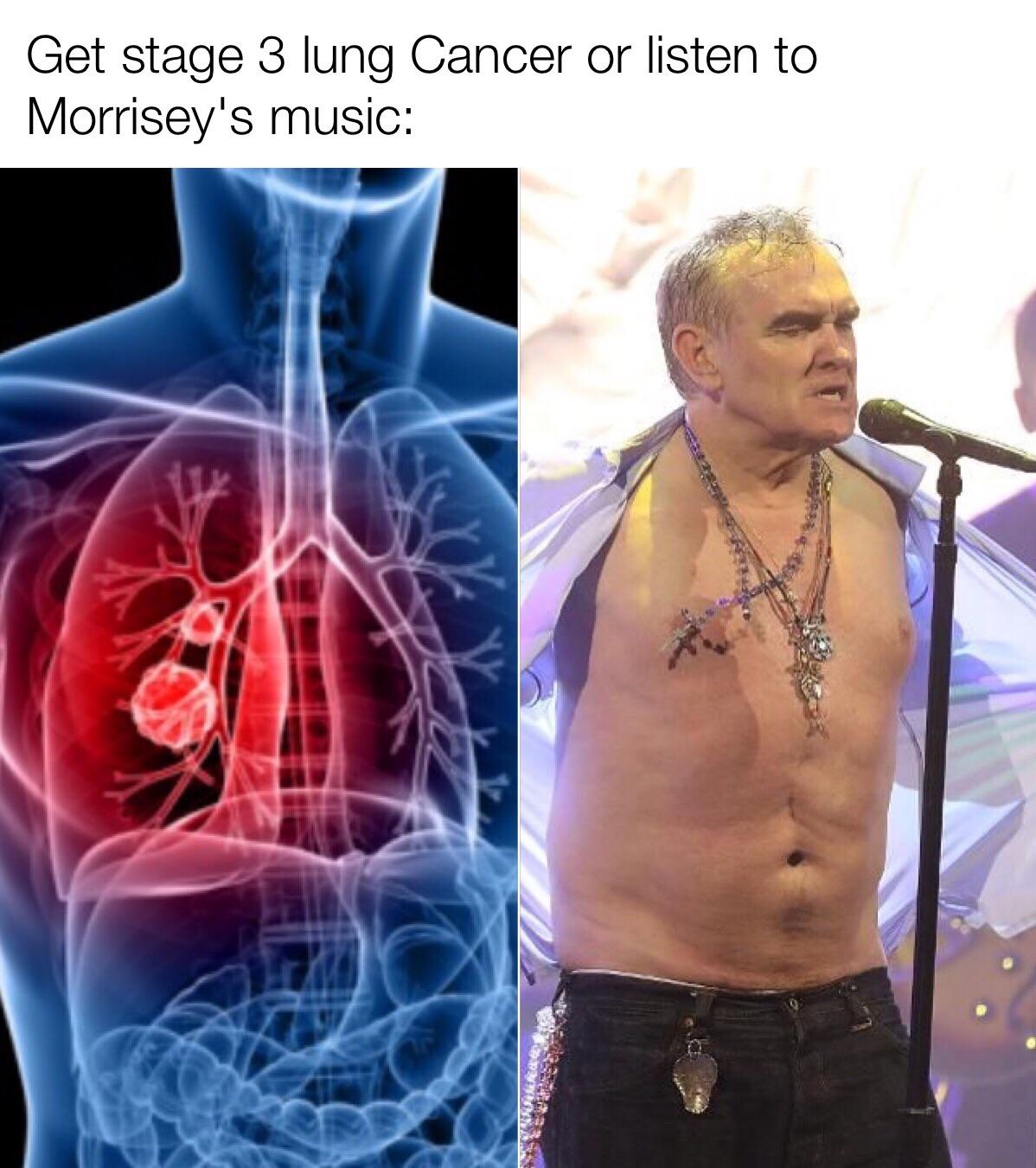 The Smiths is the only exception | Scrolller