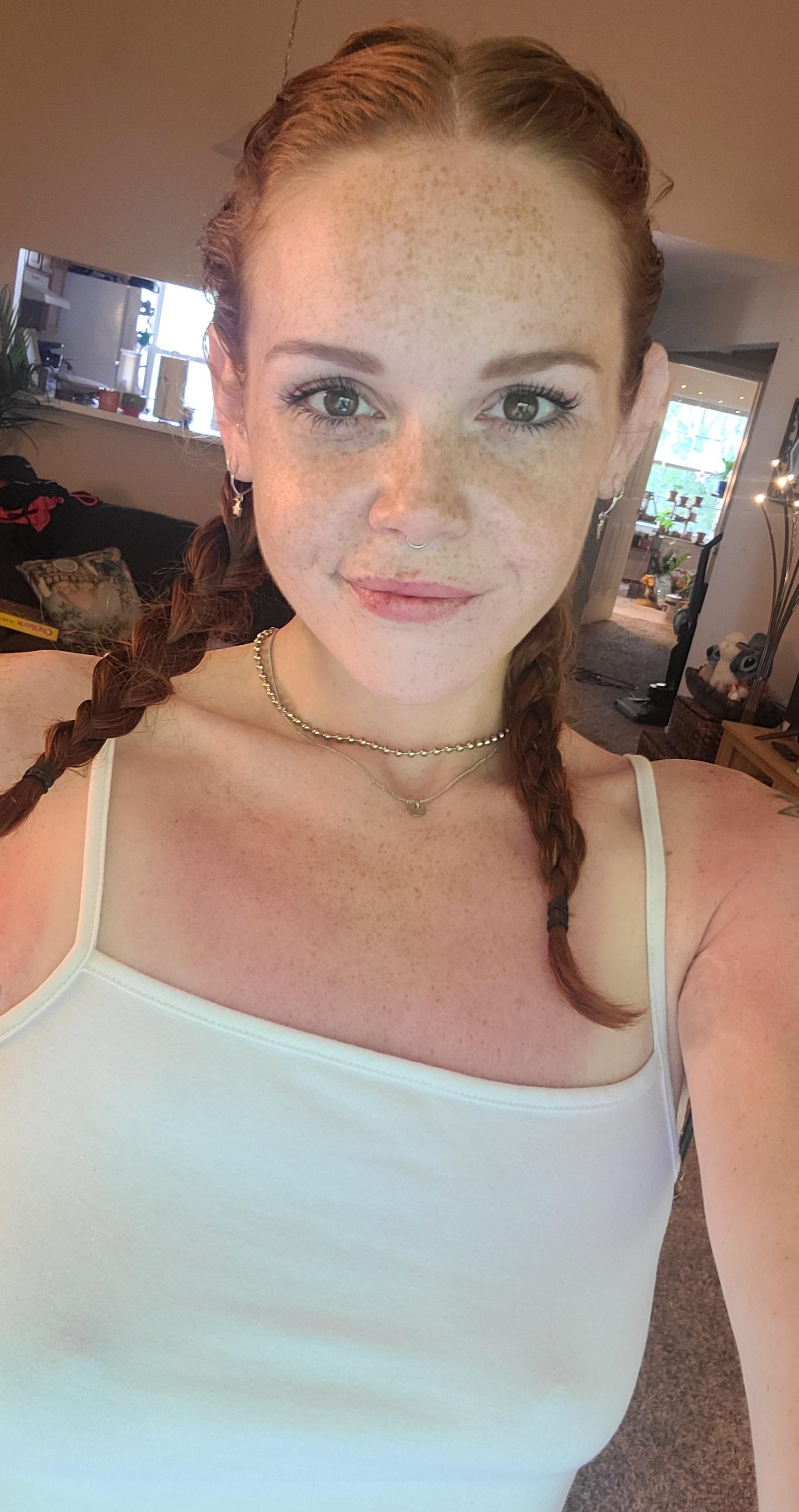 the sun really brings out my freckles | Scrolller