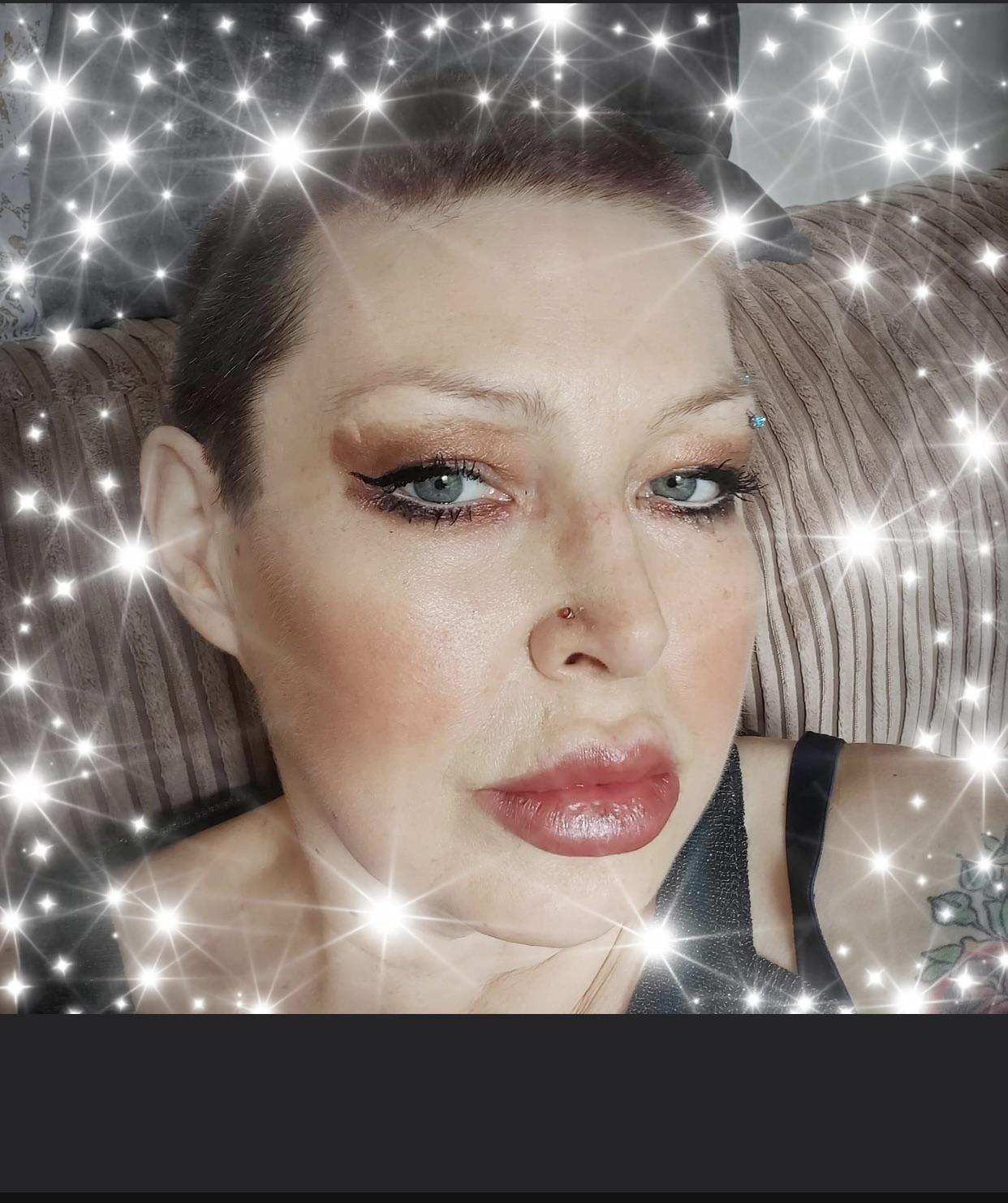 This lip filler migration… | Scrolller