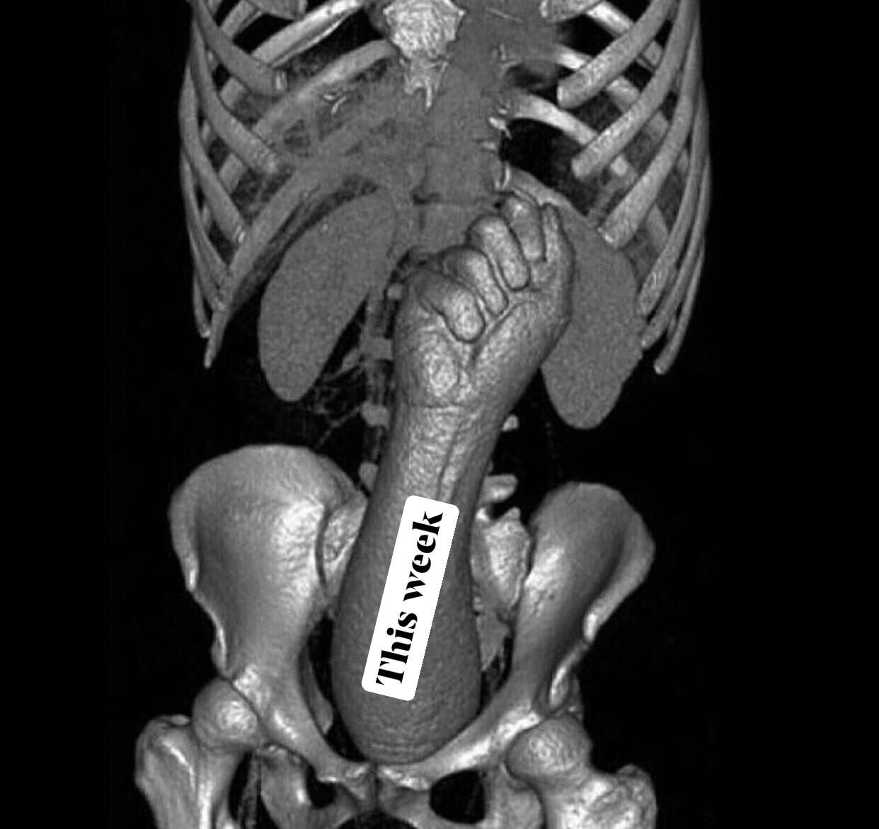 This week | Scrolller