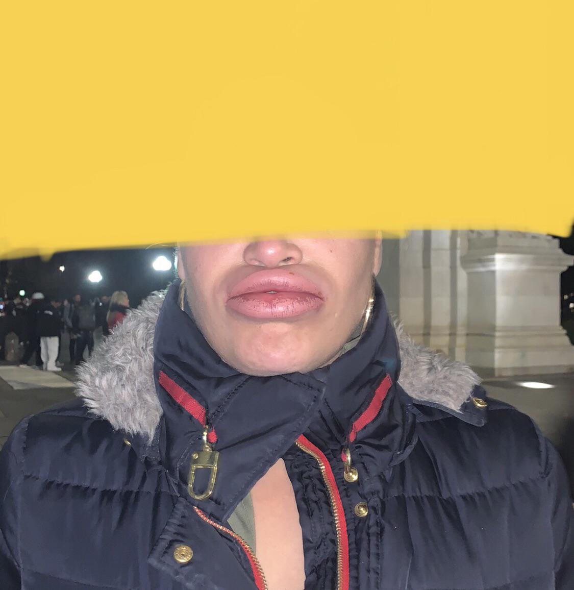 Truly botched… | Scrolller