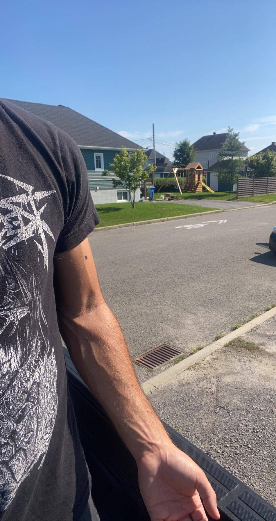 Vacation veins | Scrolller