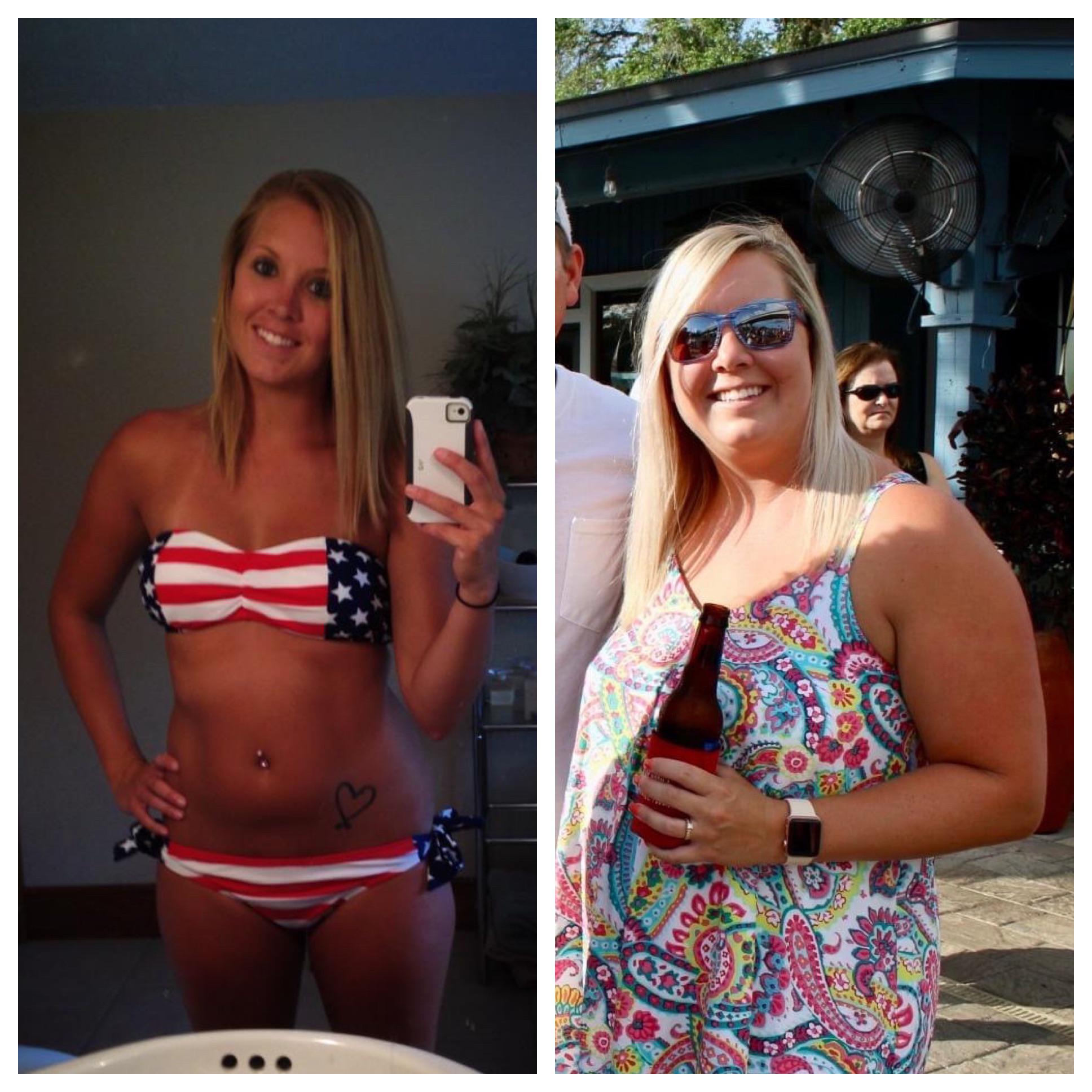 What 5 years of nonstop beer drinking does | Scrolller