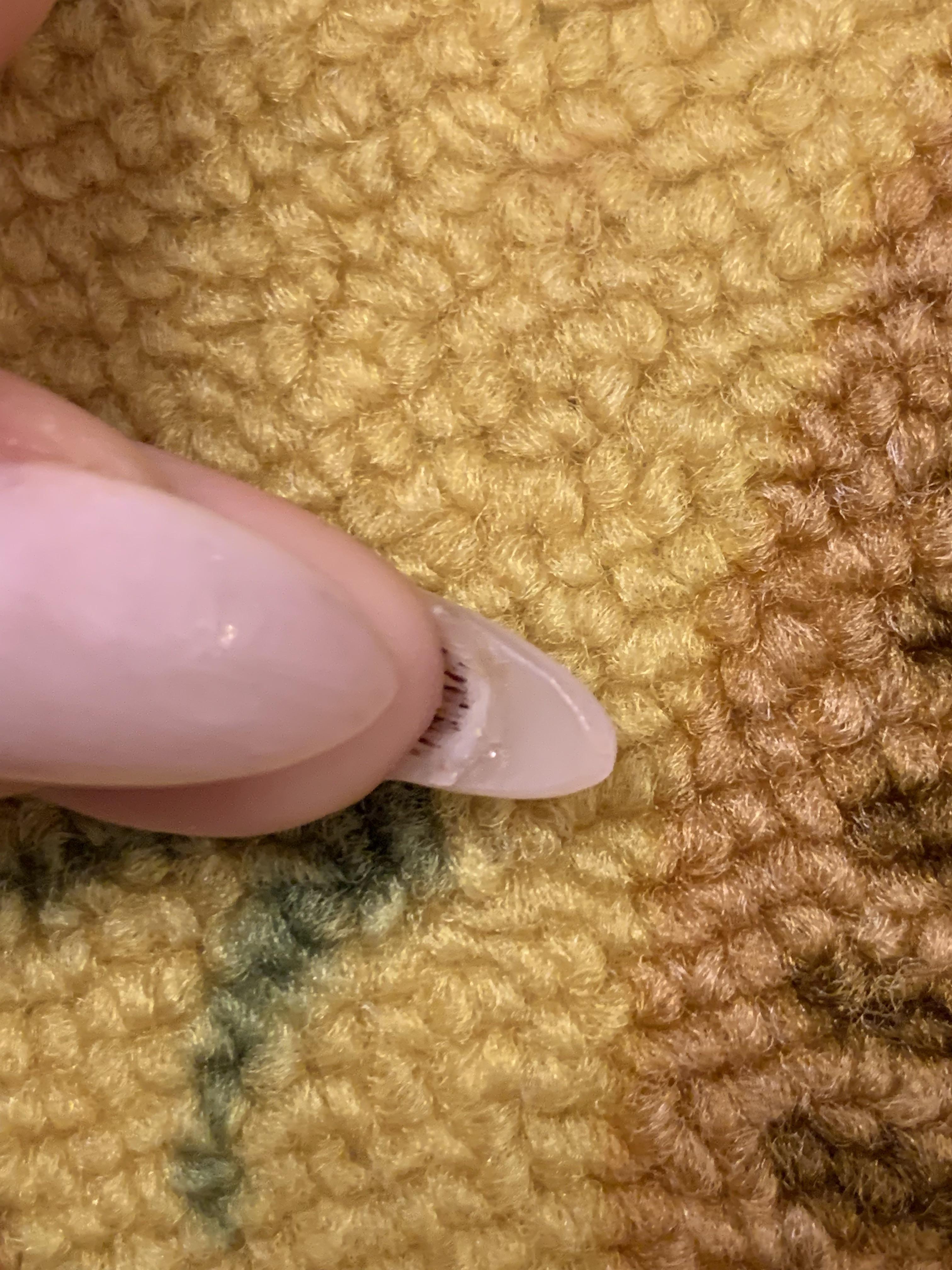 What Are These Vertical Black Lines On The Insides Of My Natural Nails